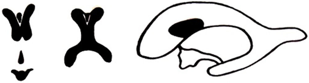 Variantes anatómicas del septum pellucidum | Revista Argentina de ...