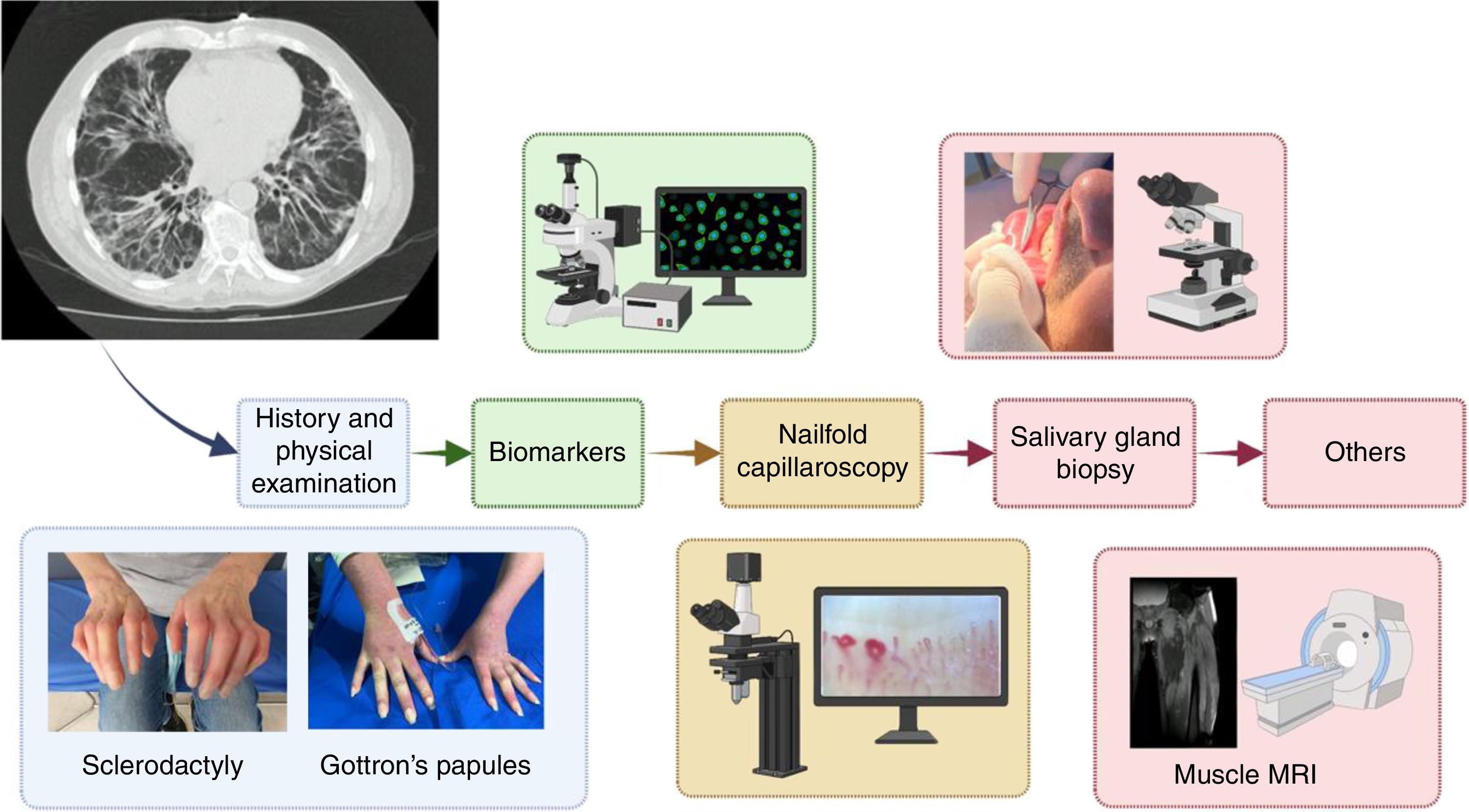 Sequential approach to interstitial lung disease: An autoimmune ...