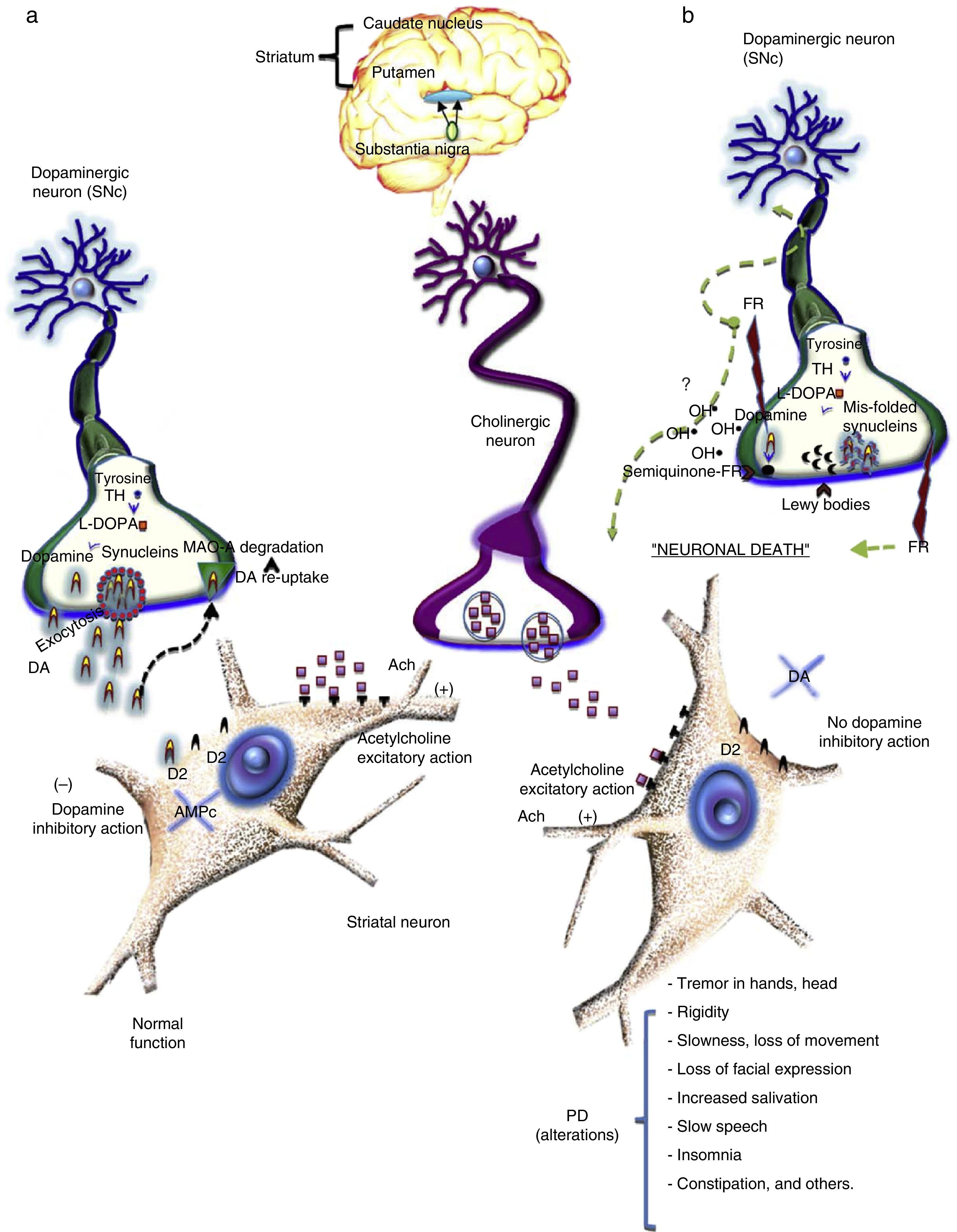 Current treatments in Parkinson's including the proposal of an ...