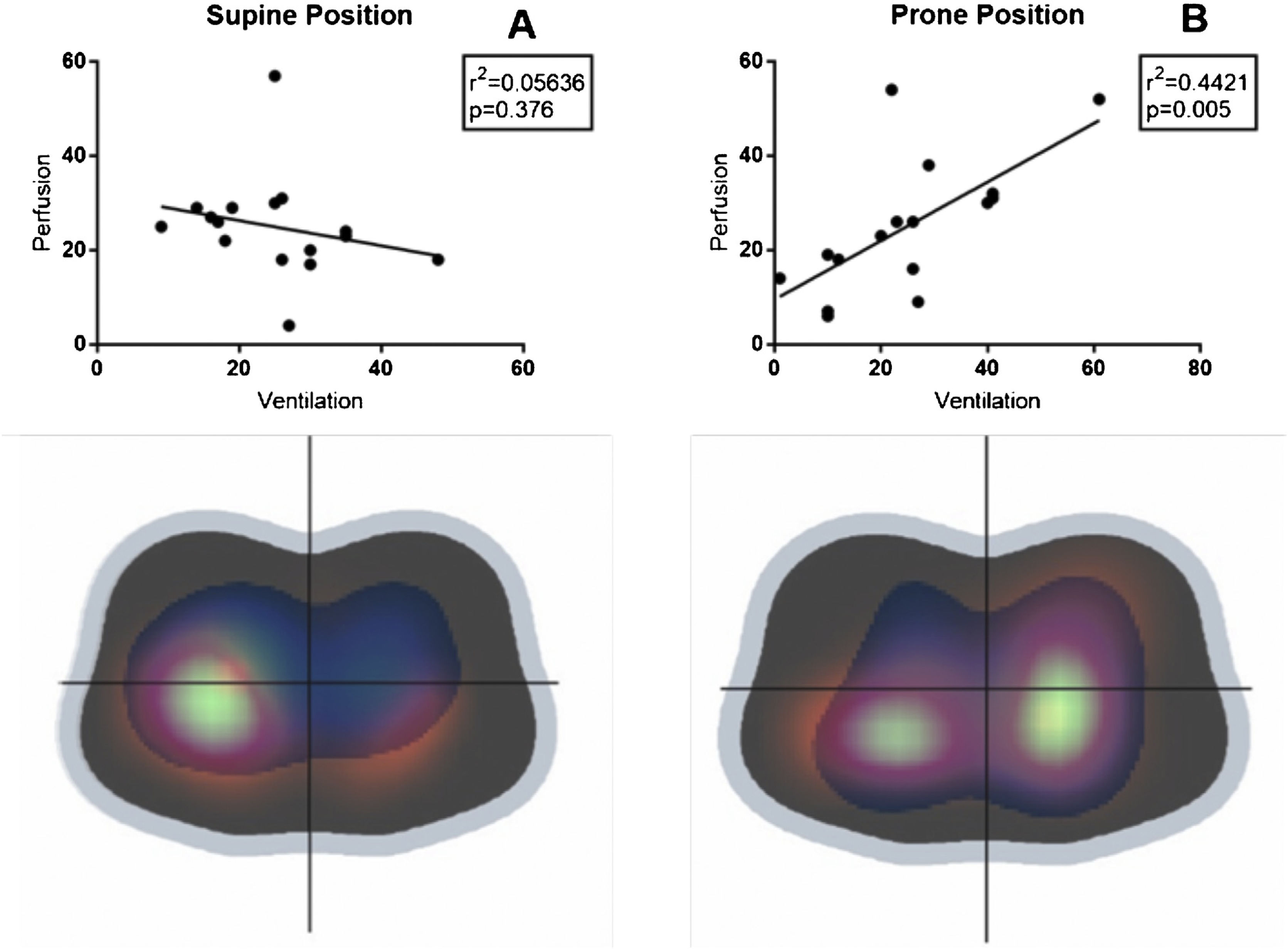 prone position ards physiology