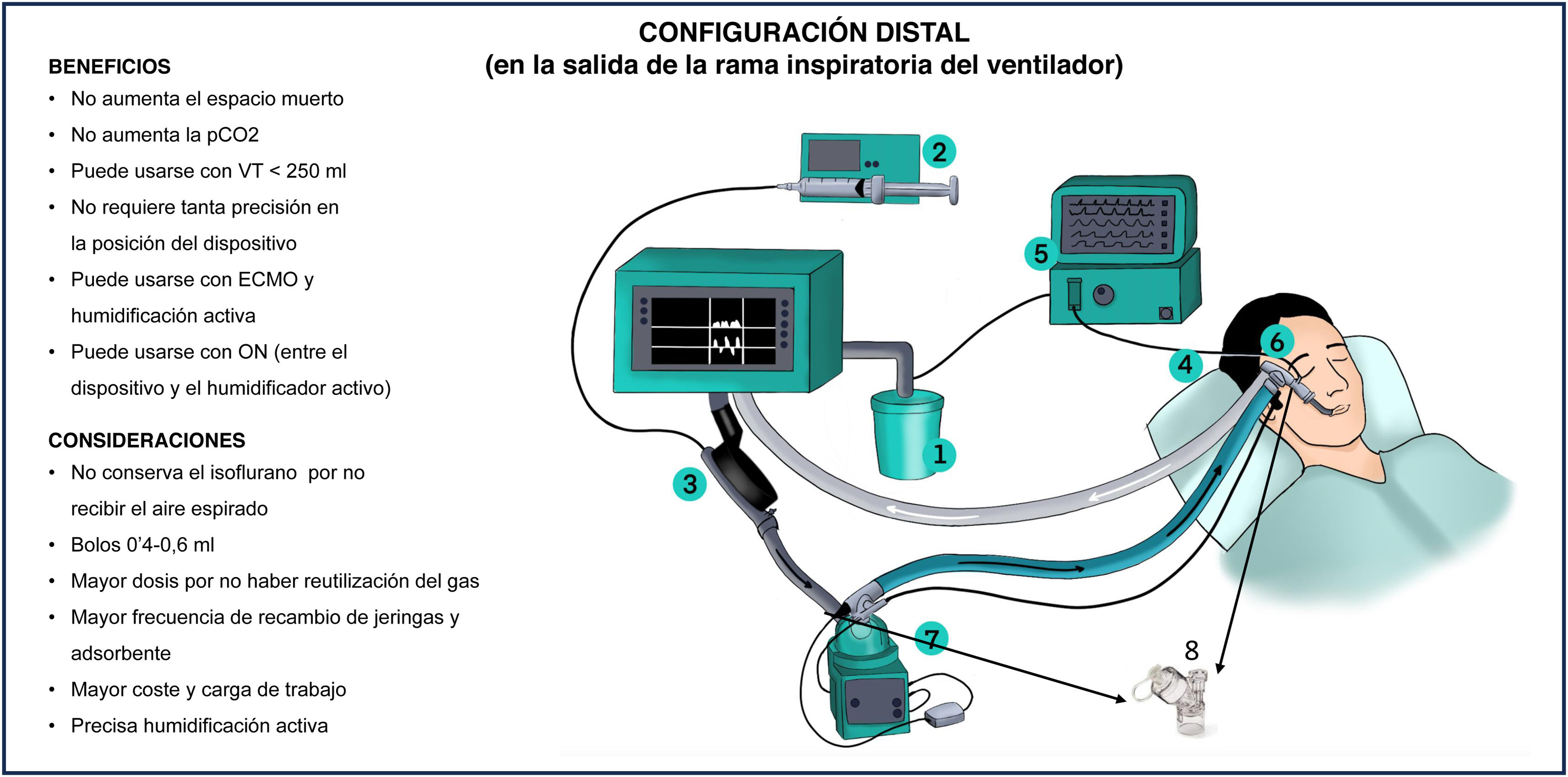 Abordaje práctico de la sedación inhalada en el paciente crítico ...