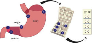 Implementation of the updated Sydney system biopsy protocol improves ...