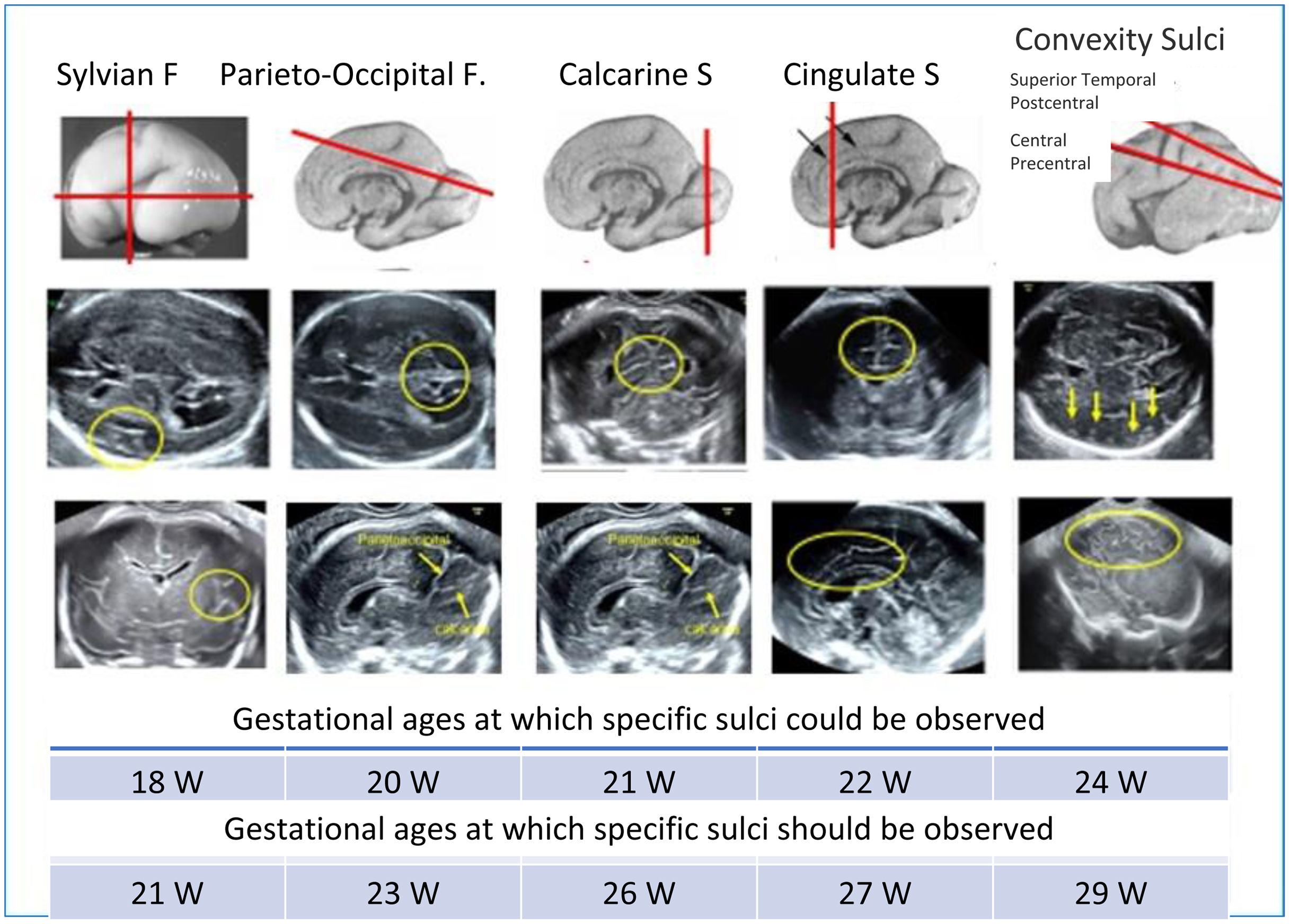 How to perform a fetal neurosonography: Key points | Clínica e ...