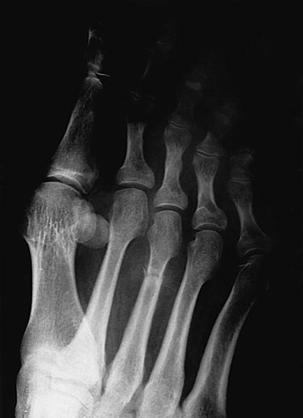 Radiografía ósea | Medicina Integral