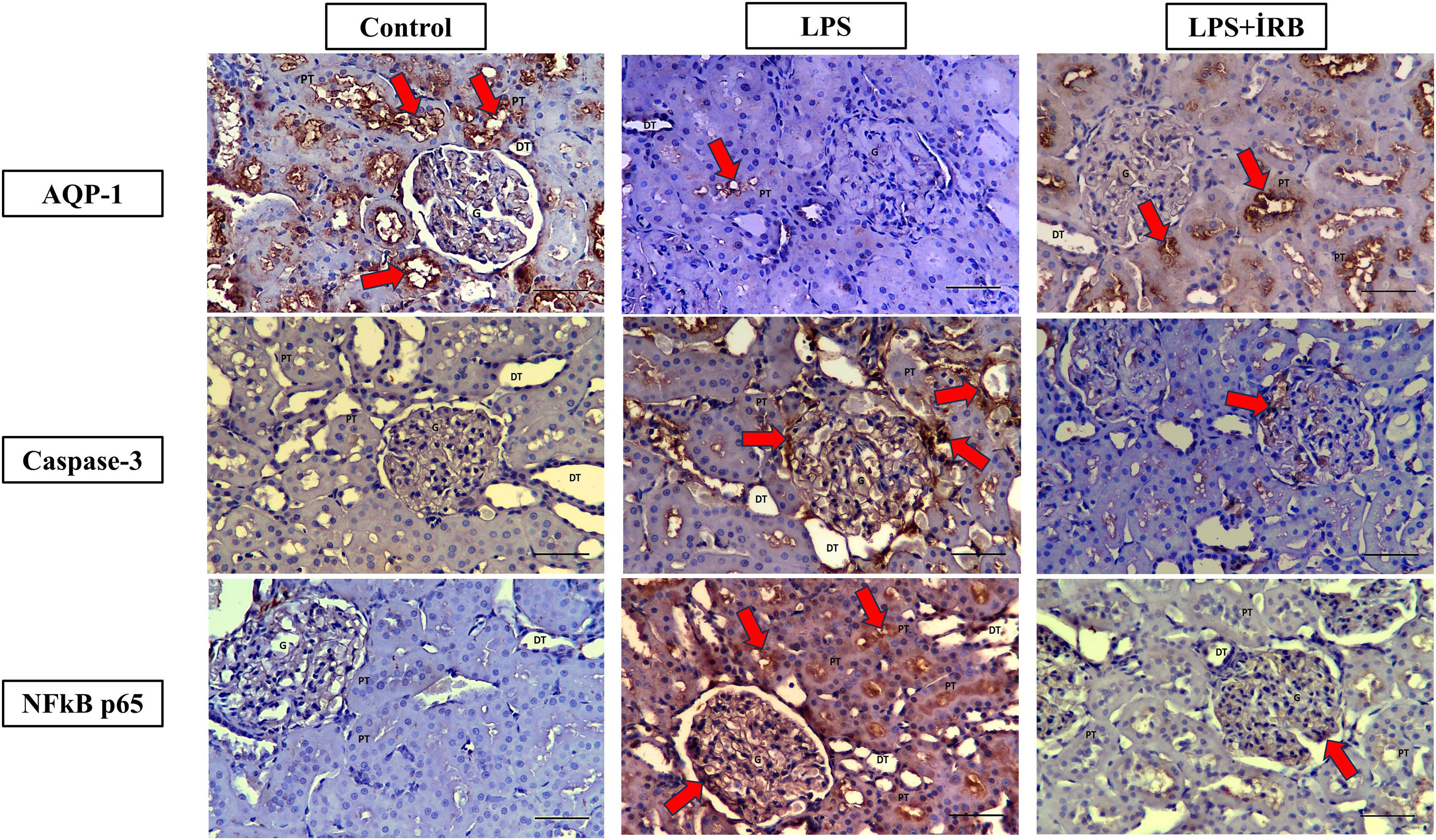 Irbesartan restored aquaporin-1 levels via inhibition of NF-kB ...