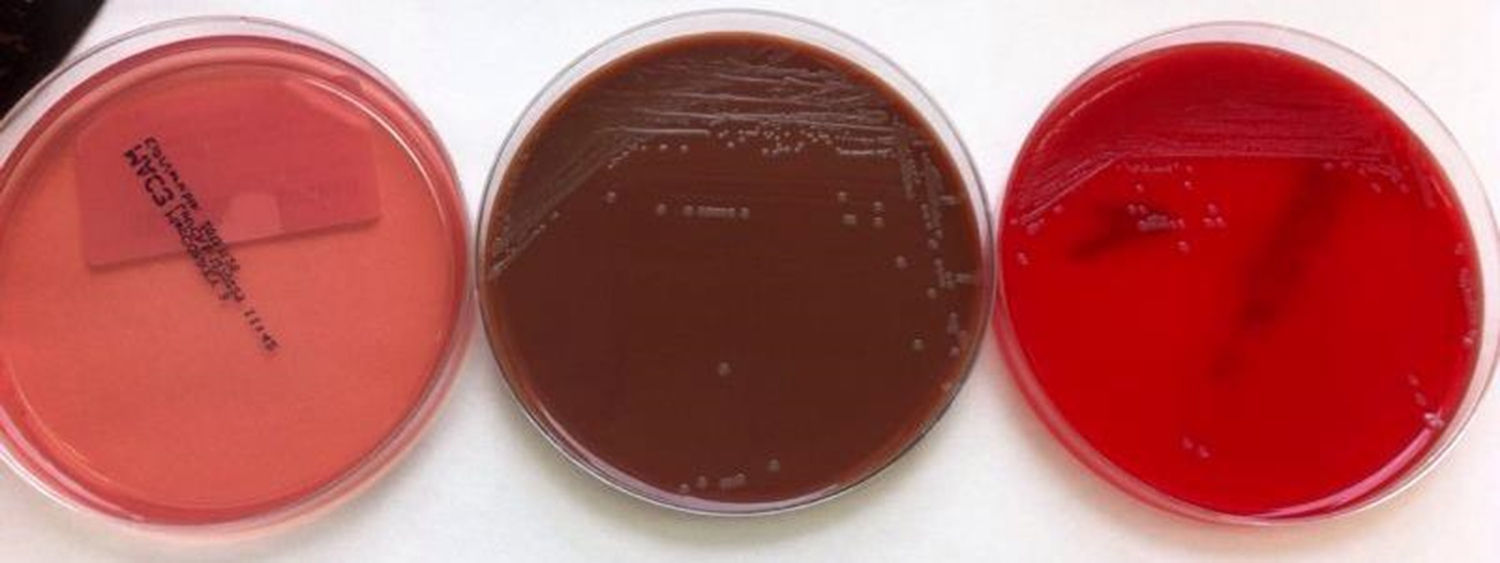 pasteurella multocida agar