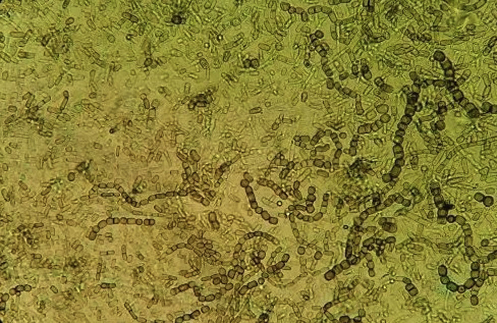 Dermatomycosis due to Neoscytalidium spp. | Enfermedades Infecciosas y ...