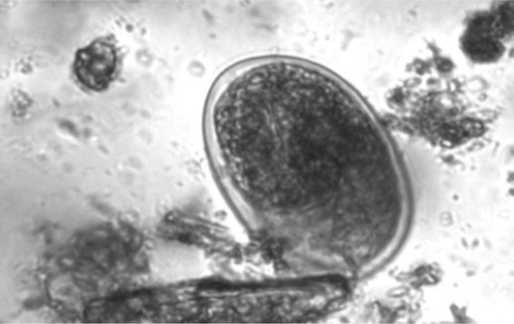 Diagnóstico de las infecciones por geohelmintos. Un problema sin ...