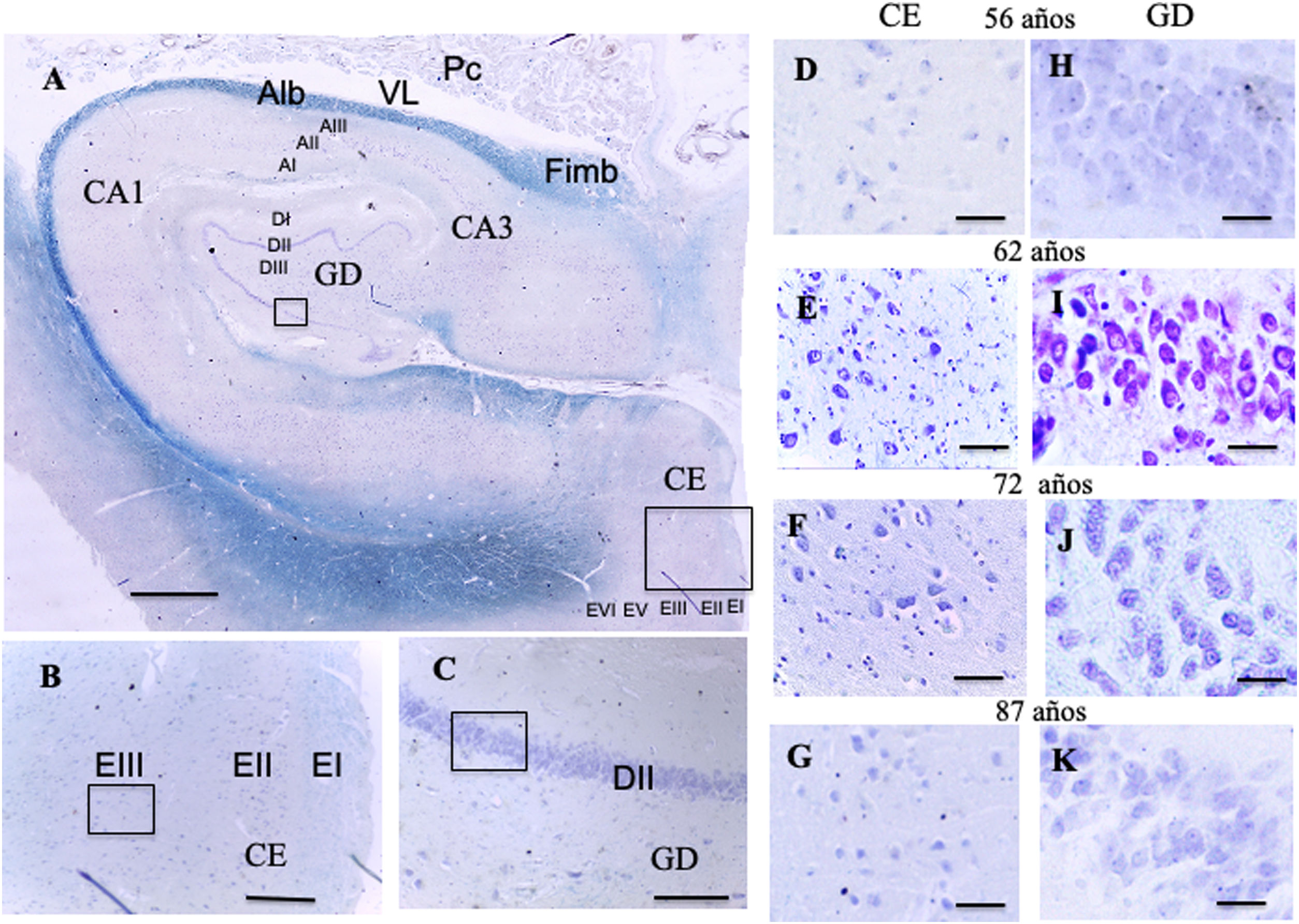 Variaciones de las células de cuadrícula y de posicionamiento de la ...