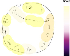 Clock drawing test with convolutional neural networks to discriminate ...