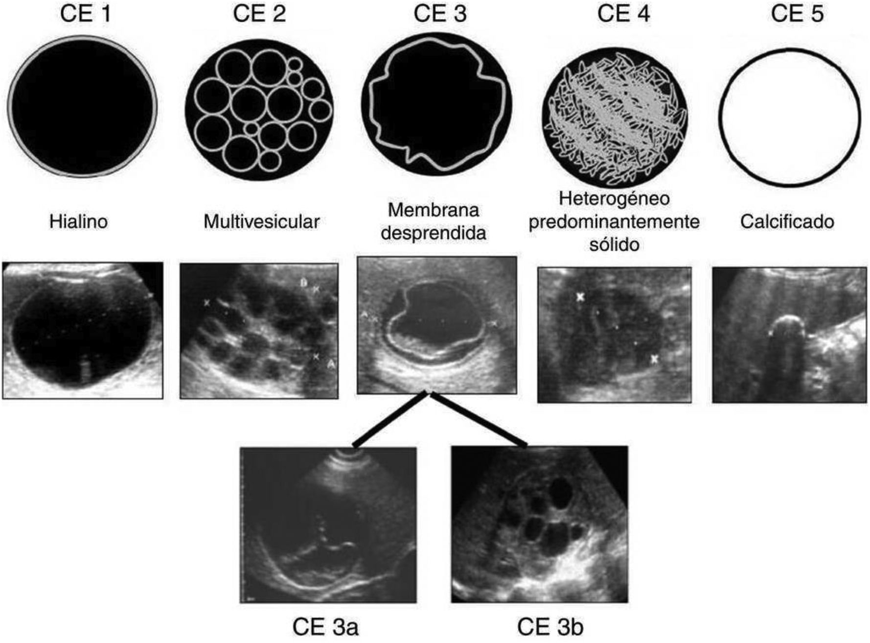 echinococcus multilocularis en humanos
