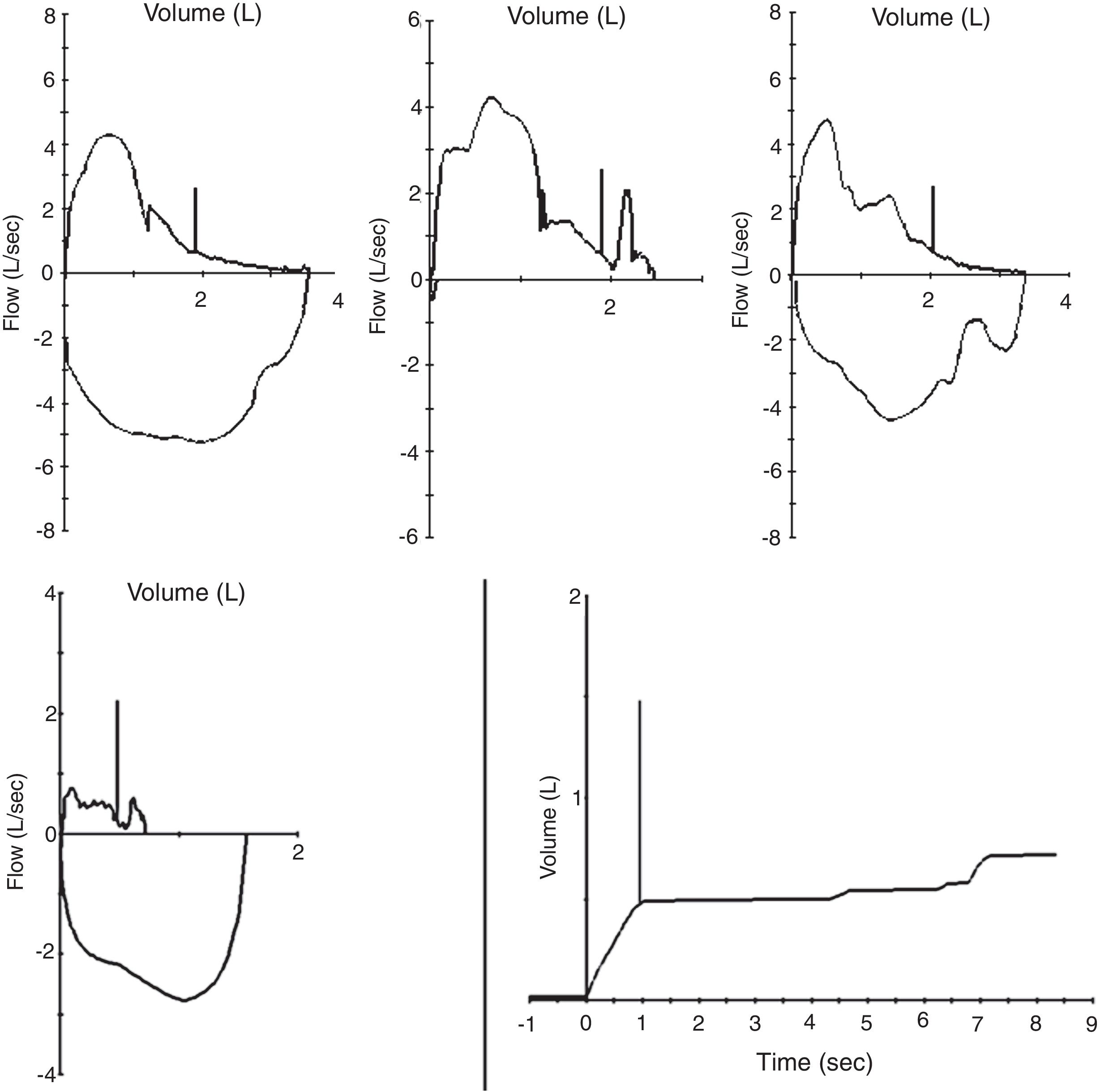 Caution is Advised on the Use of Quality Grading in Spirometry ...