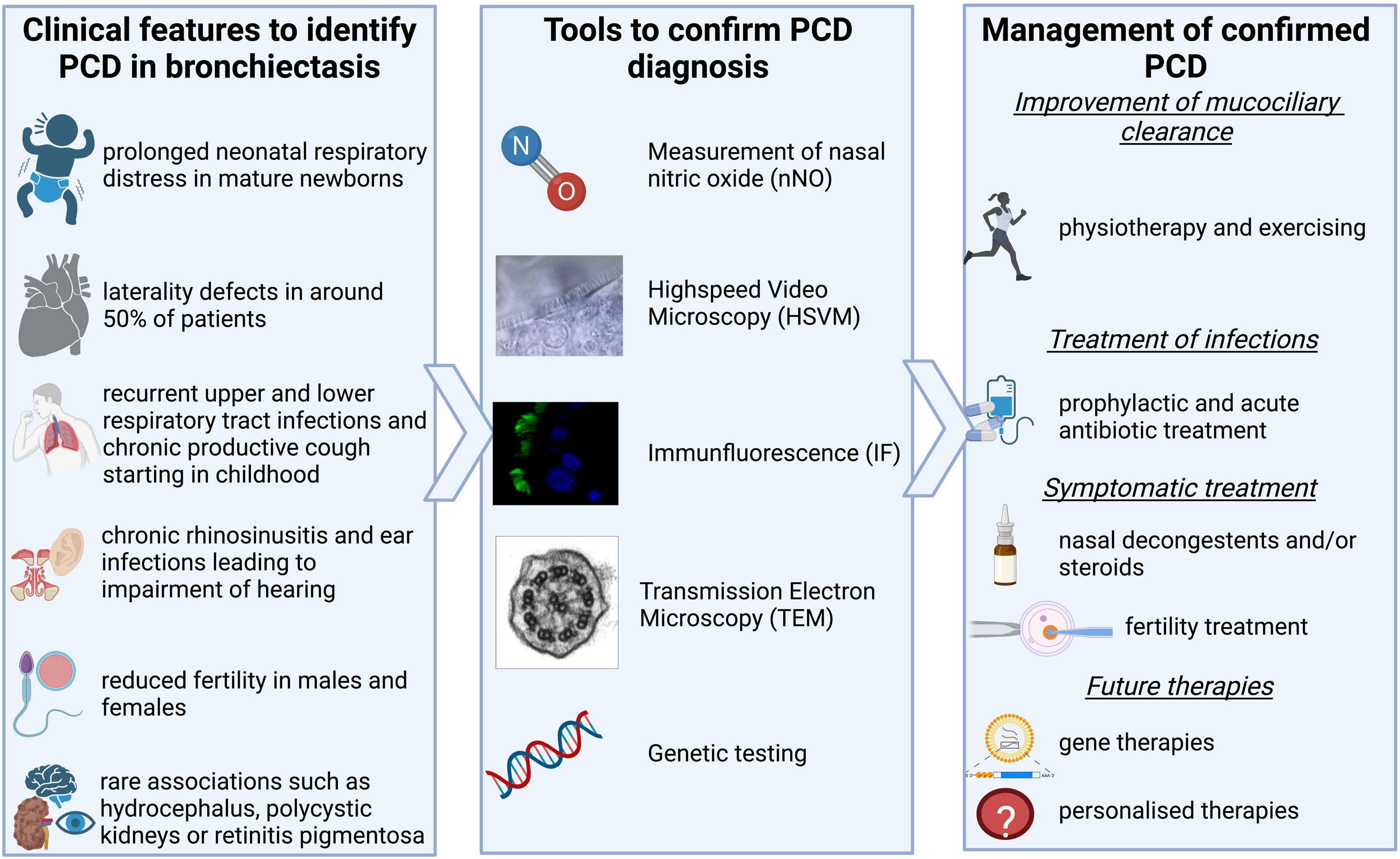 bronchiectasis treatment