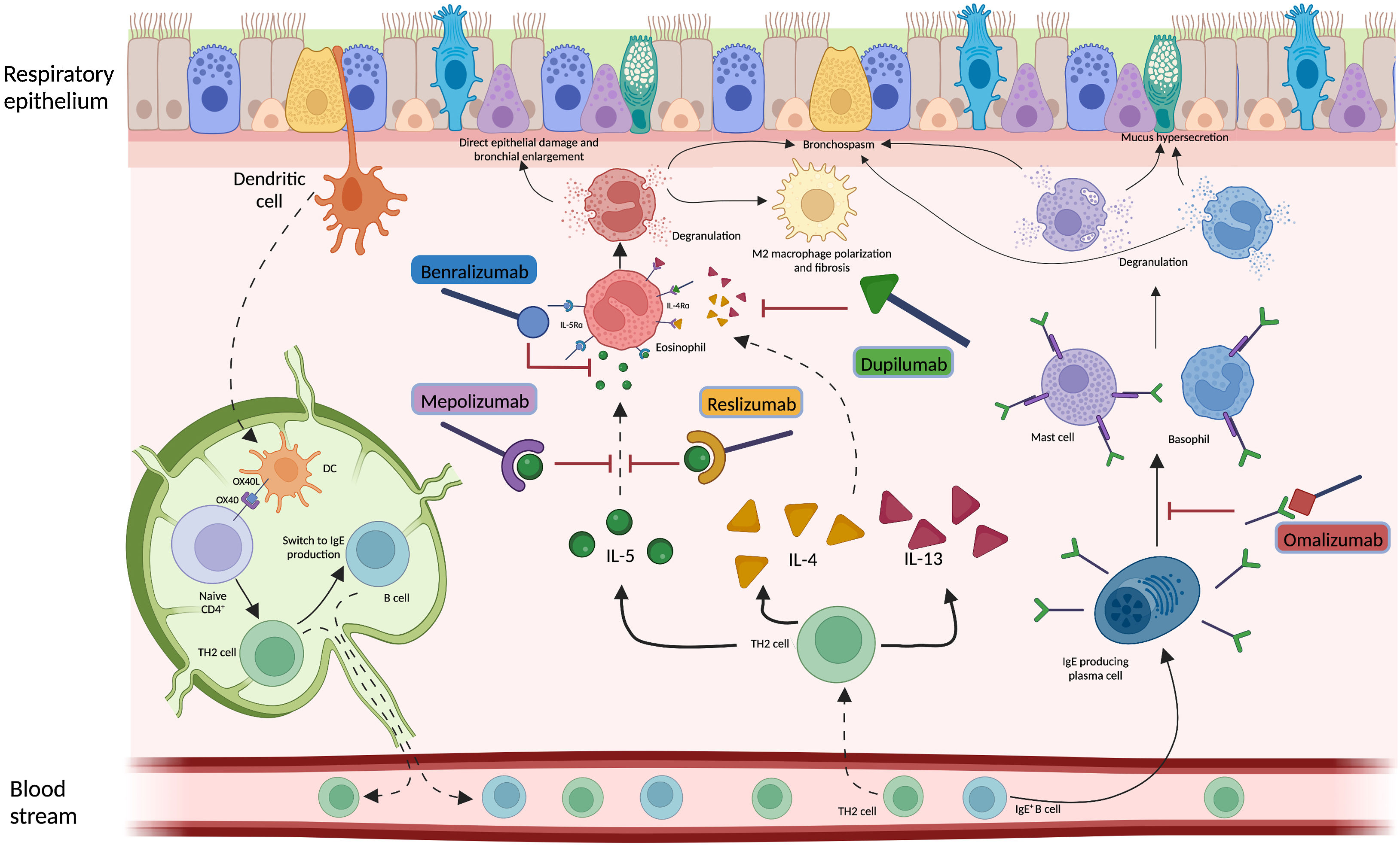 Biologics in Bronchiectasis: A Future Treatment? | Archivos de ...