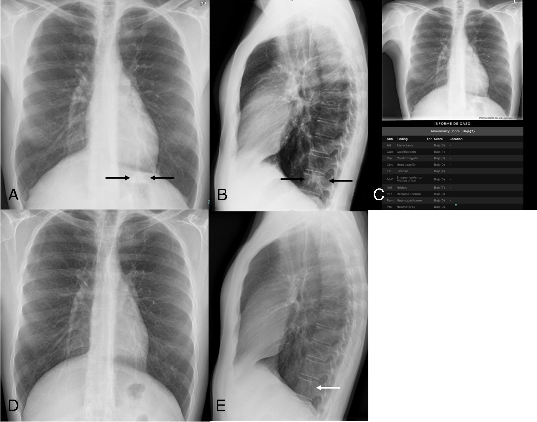 Why do Artificial-Intelligence Based Chest Radiograph Applications ...