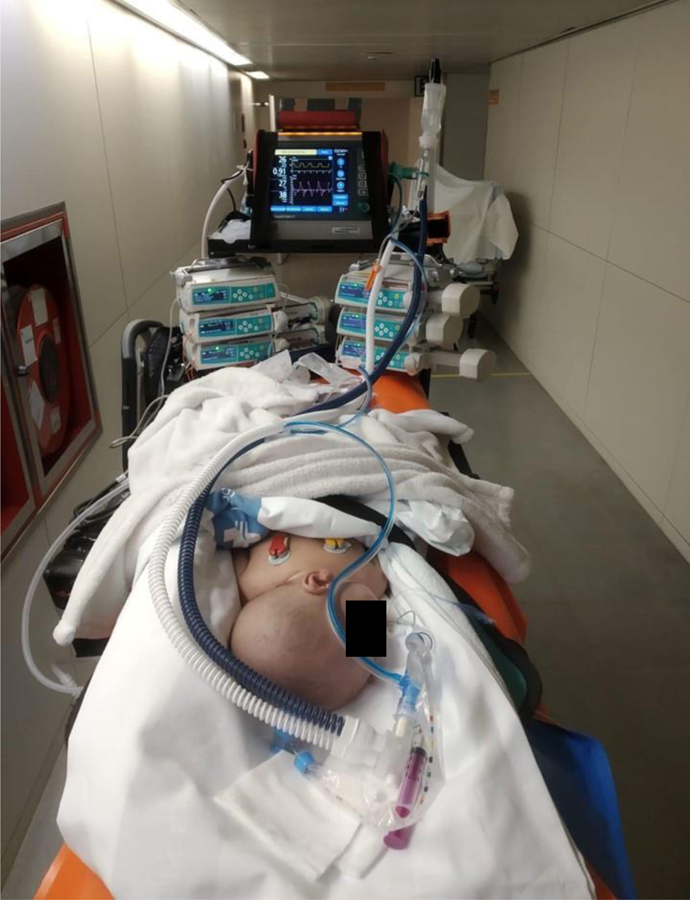 Feasibility and Safety of the Prone Position in Mechanically Ventilated Patients During ...