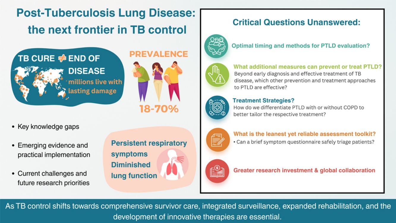 extrapulmonary tb guidelines