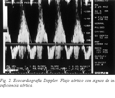 Tratamiento quirúrgico de la estenosis aórtica crítica en el niño ...