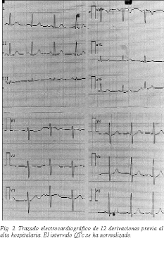 Torsade de pointes durante el tratamiento de la leishmaniasis con ...