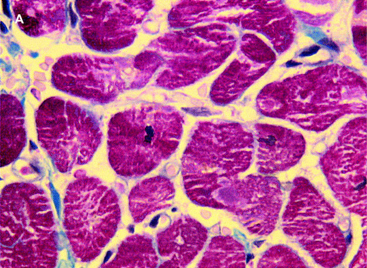 Respuestas del miocardio al estrés biomecánico | Revista Española de ...