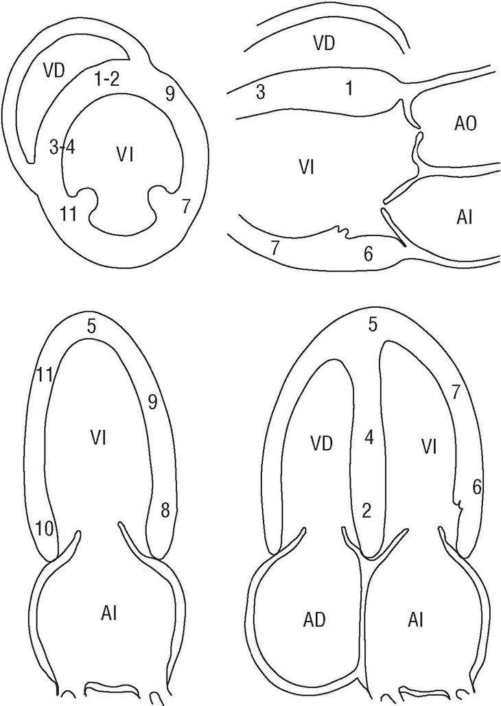 Comparación entre la eco-dobutamina y talio-201 SPECT reposo ...