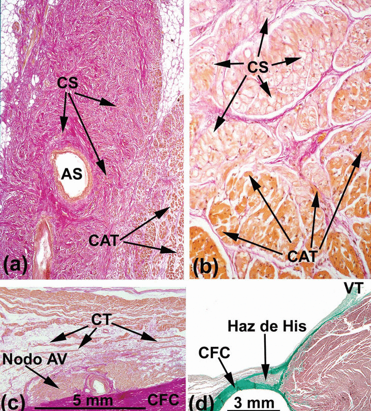 Anatomía de los nodos cardíacos y del sistema de conducción específico ...