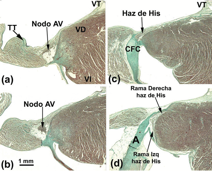 Anatomía de los nodos cardíacos y del sistema de conducción específico ...