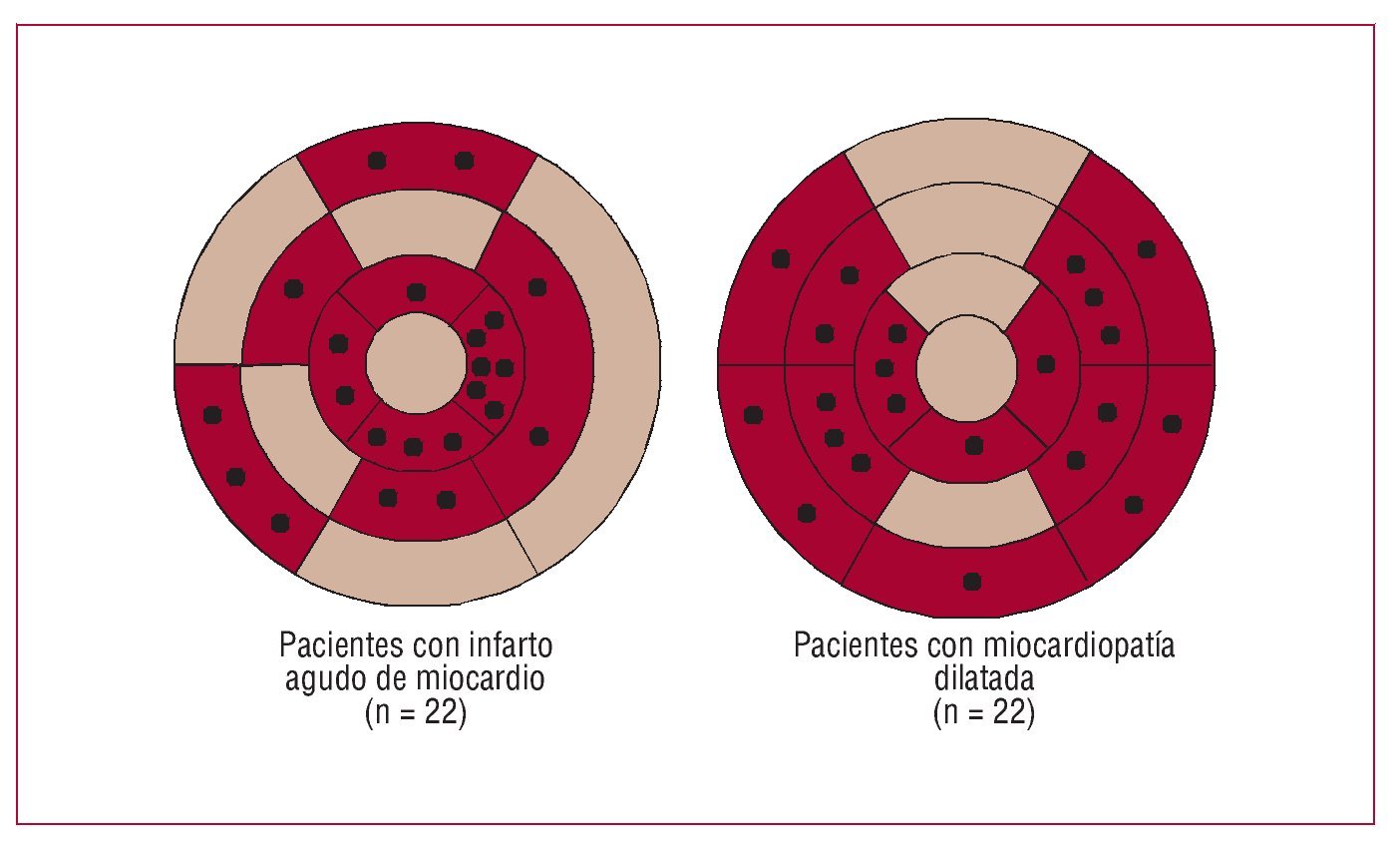 Estudio de la asincronía ventricular izquierda con ecocardiografía ...