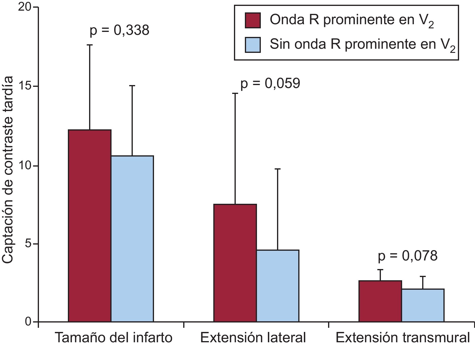 La onda R prominente en V 1 pero no en V 2 es un signo específico de ...