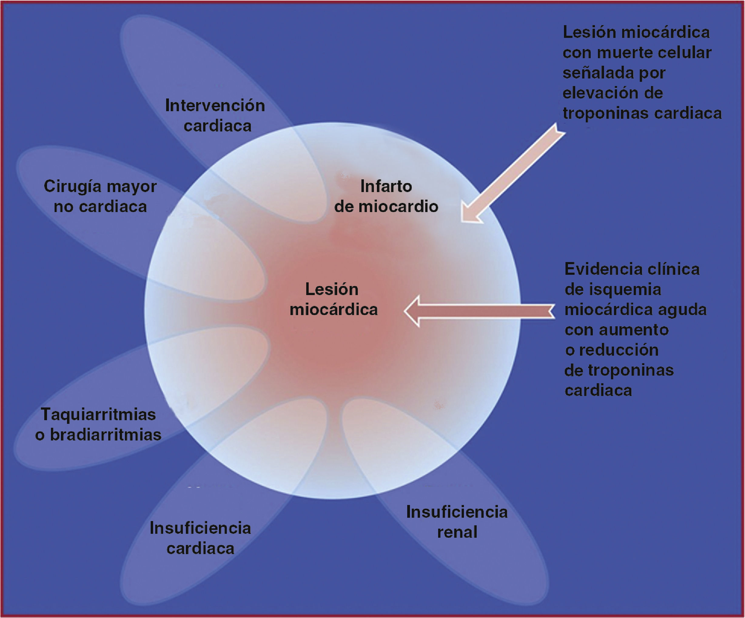 Documento de consenso de expertos. Tercera definición universal del ...