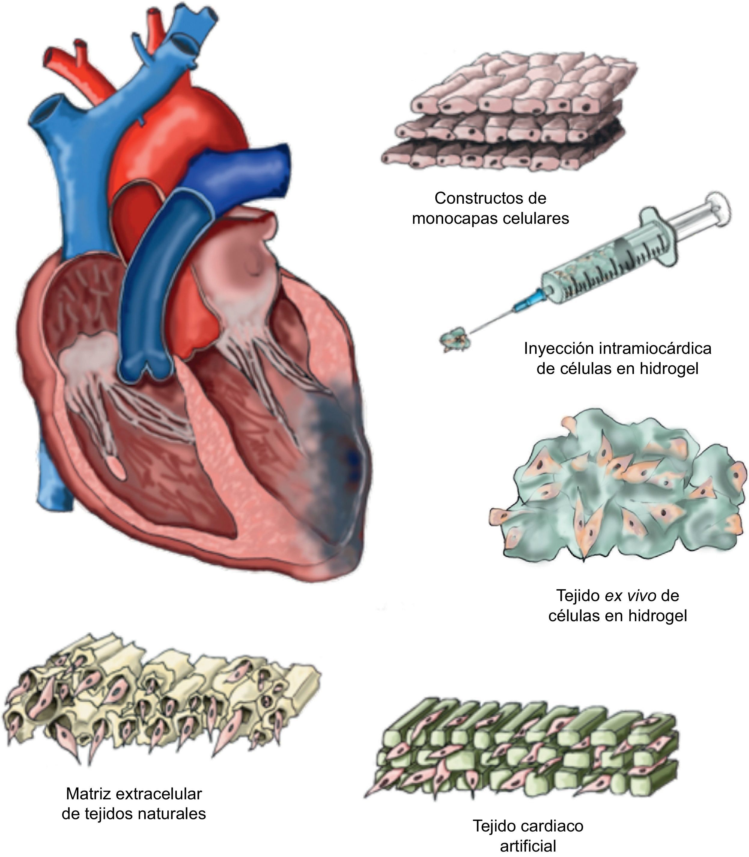 Ingeniería tisular cardiaca y corazón bioartificial | Revista Española ...