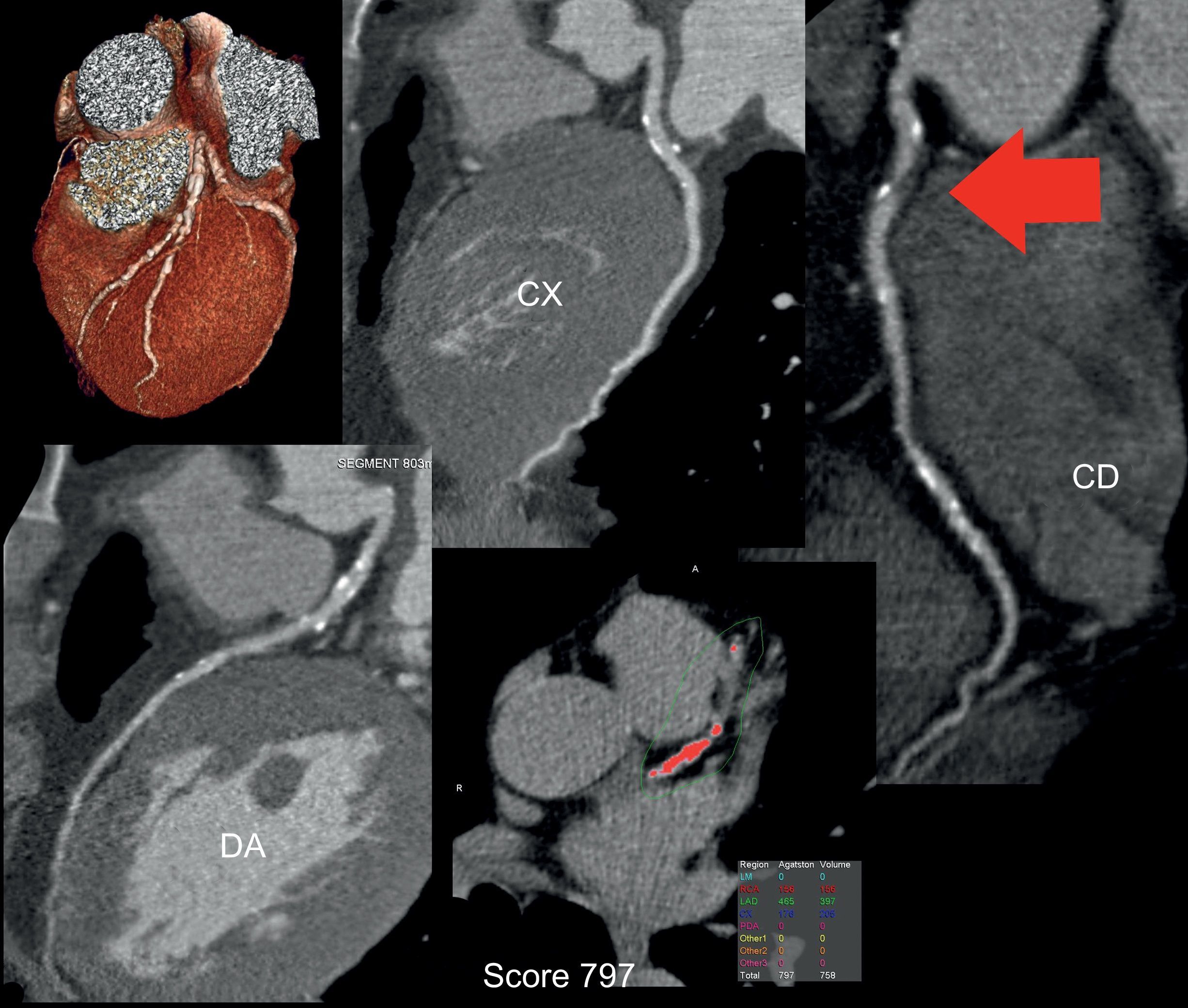 Novedades en imagen cardiaca 2013 - Revista Española de Cardiología