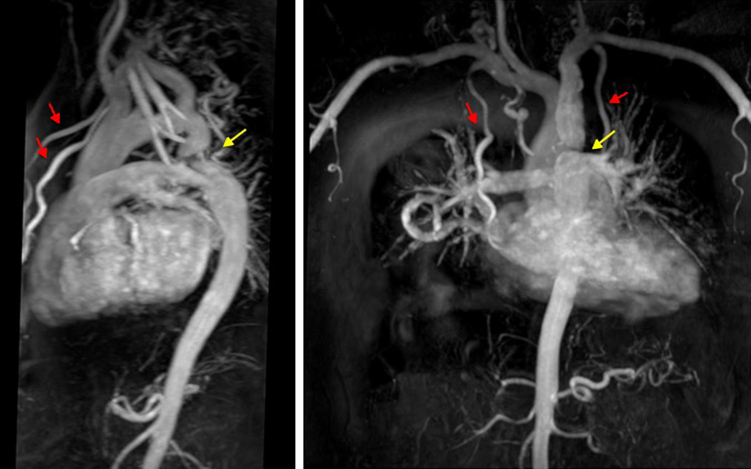 Resonancia magnética cardiovascular en la práctica cardiológica: una ...