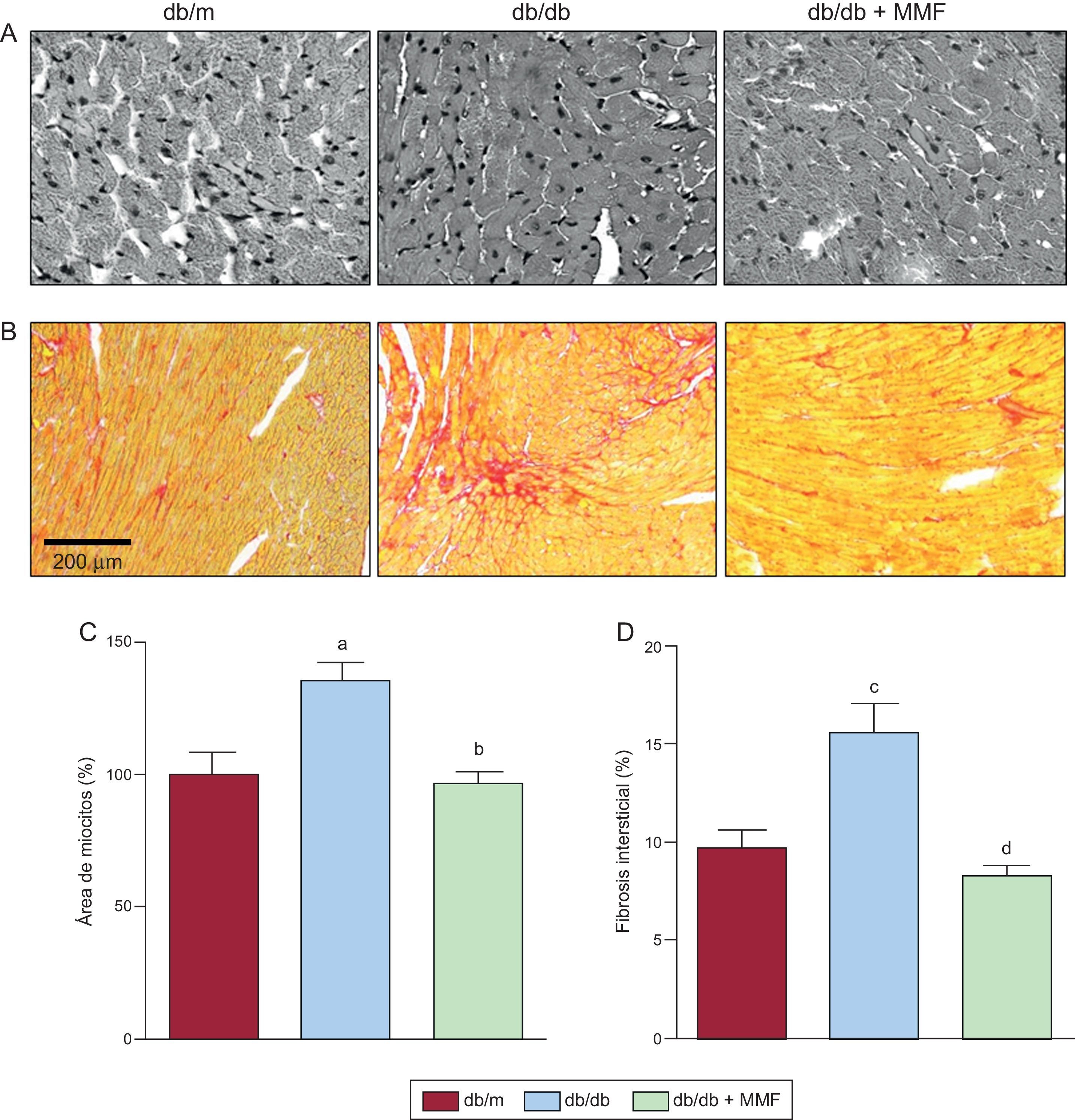 Efecto de micofenolato mofetilo en la miocardiopatía diabética de ...