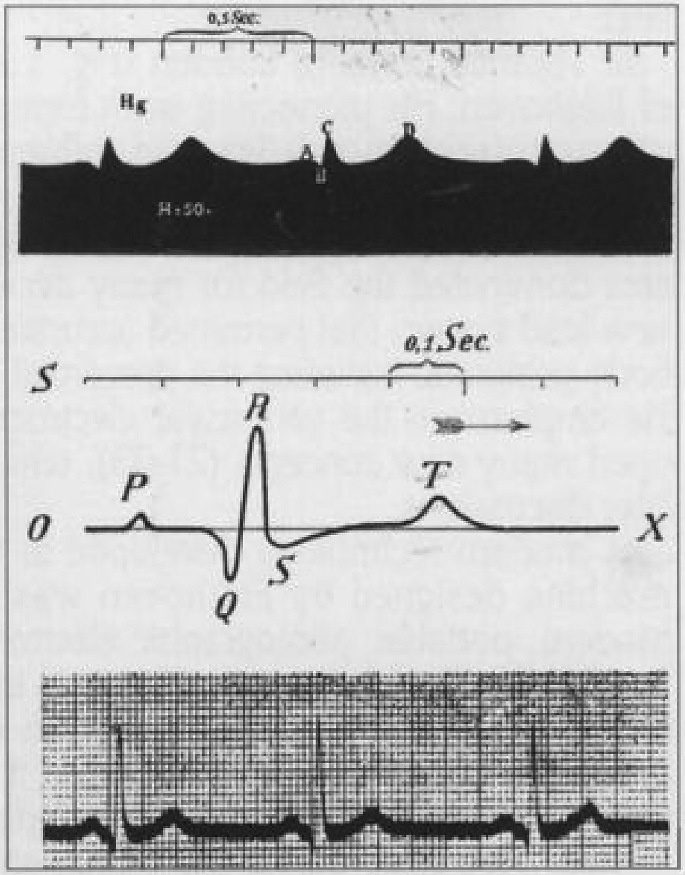 EKG | Revista Española de Cardiología