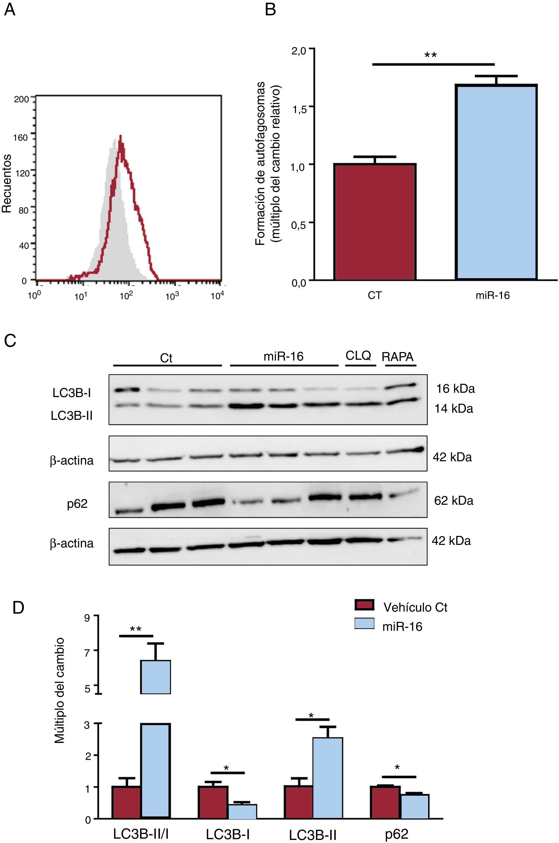 Fisiopatología de la miocardiopatía dilatada isquémica a través del ...