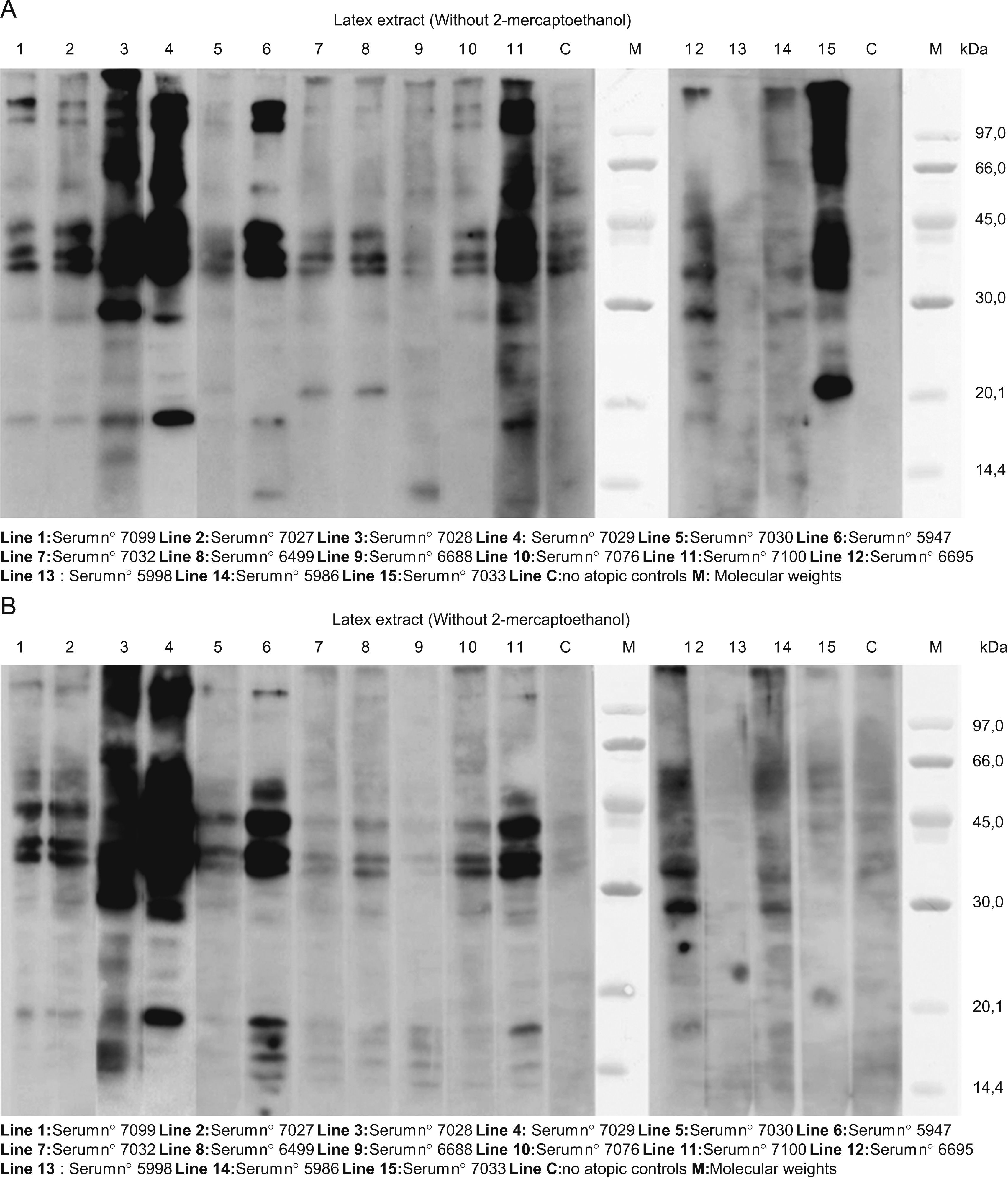 Clinical significance of cross-reactivity between tobacco and latex ...