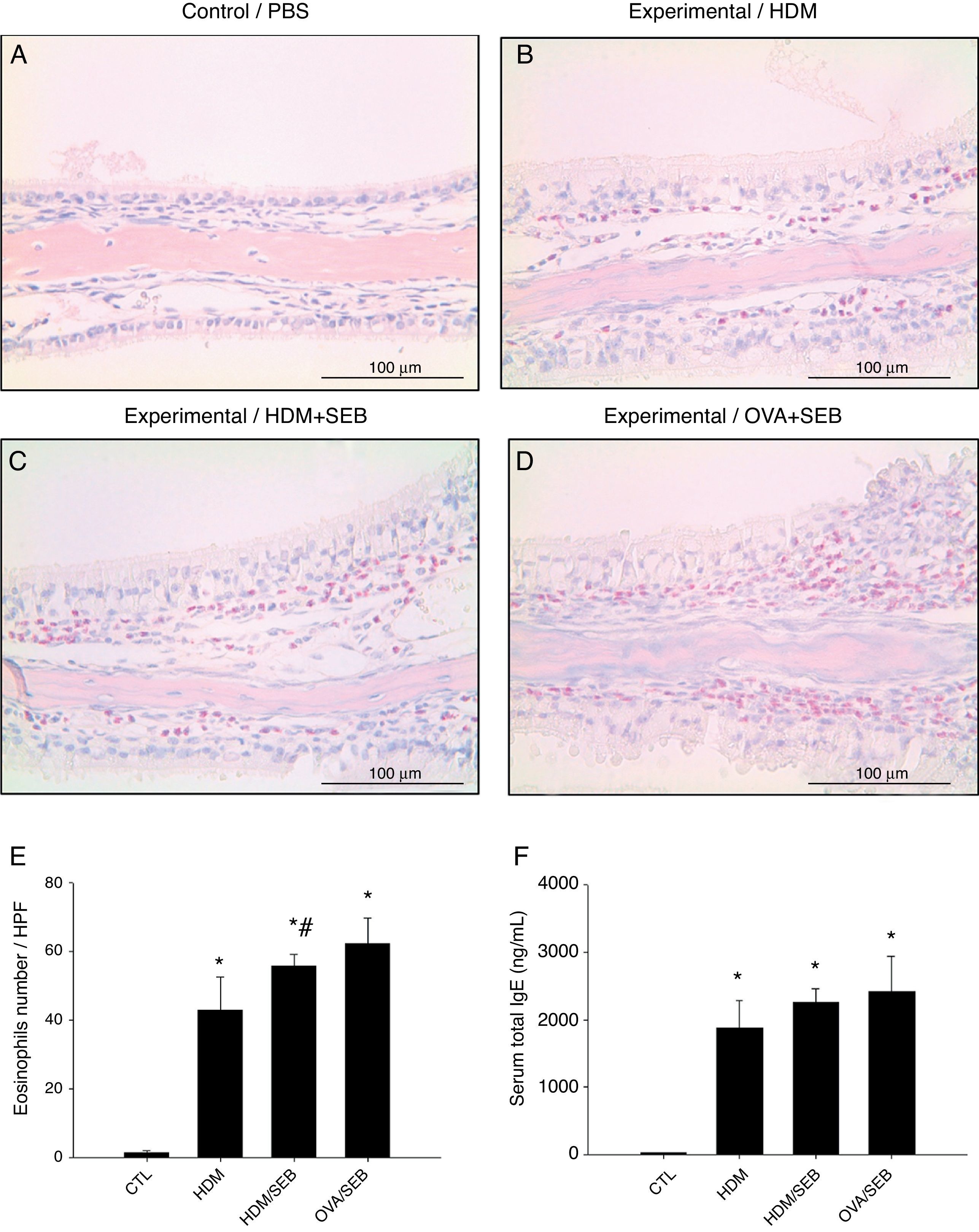 Induction of nasal polyps using house dust mite and Staphylococcal ...