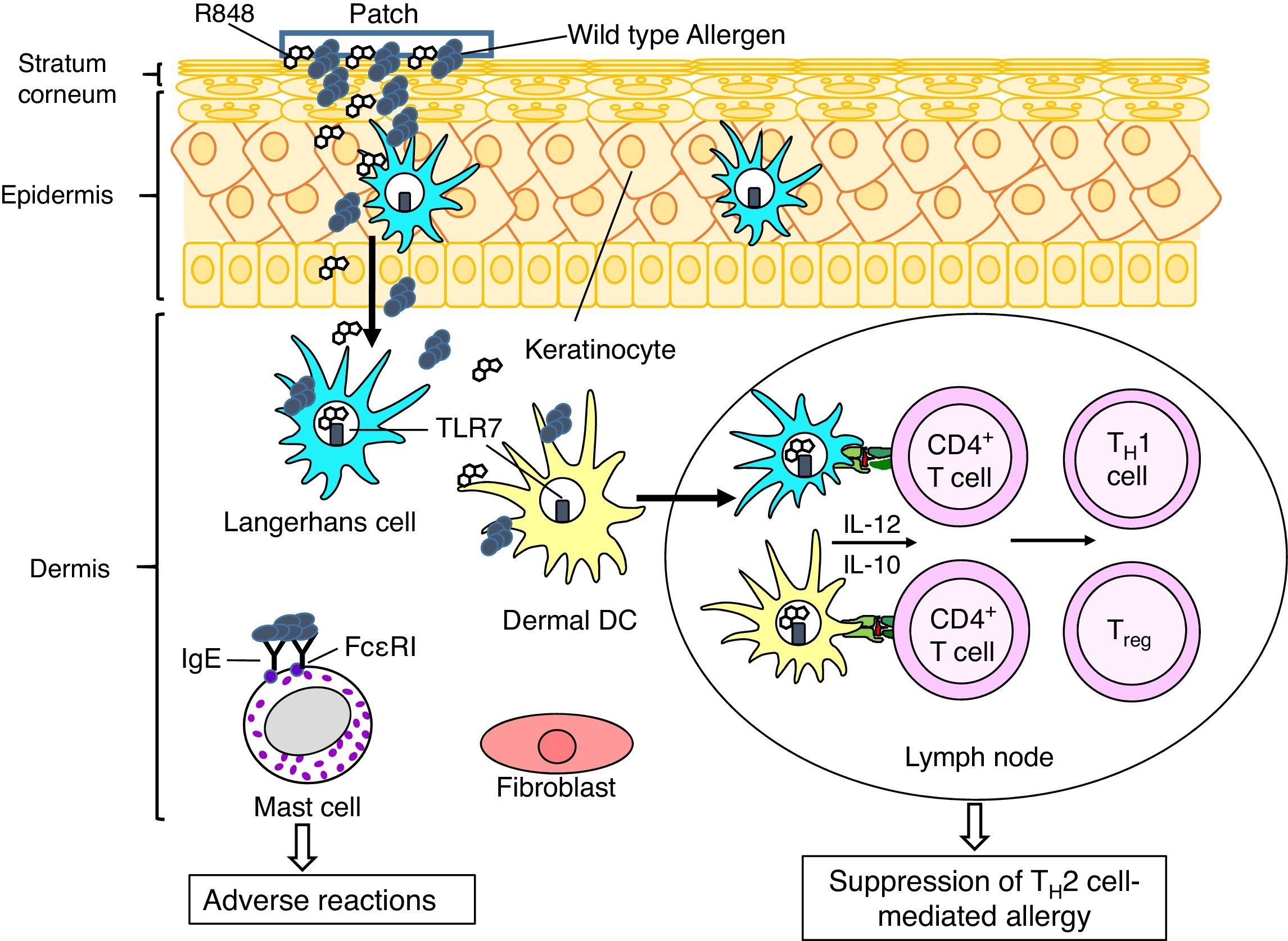 Epicutaneous immunotherapy | Allergologia et Immunopathologia