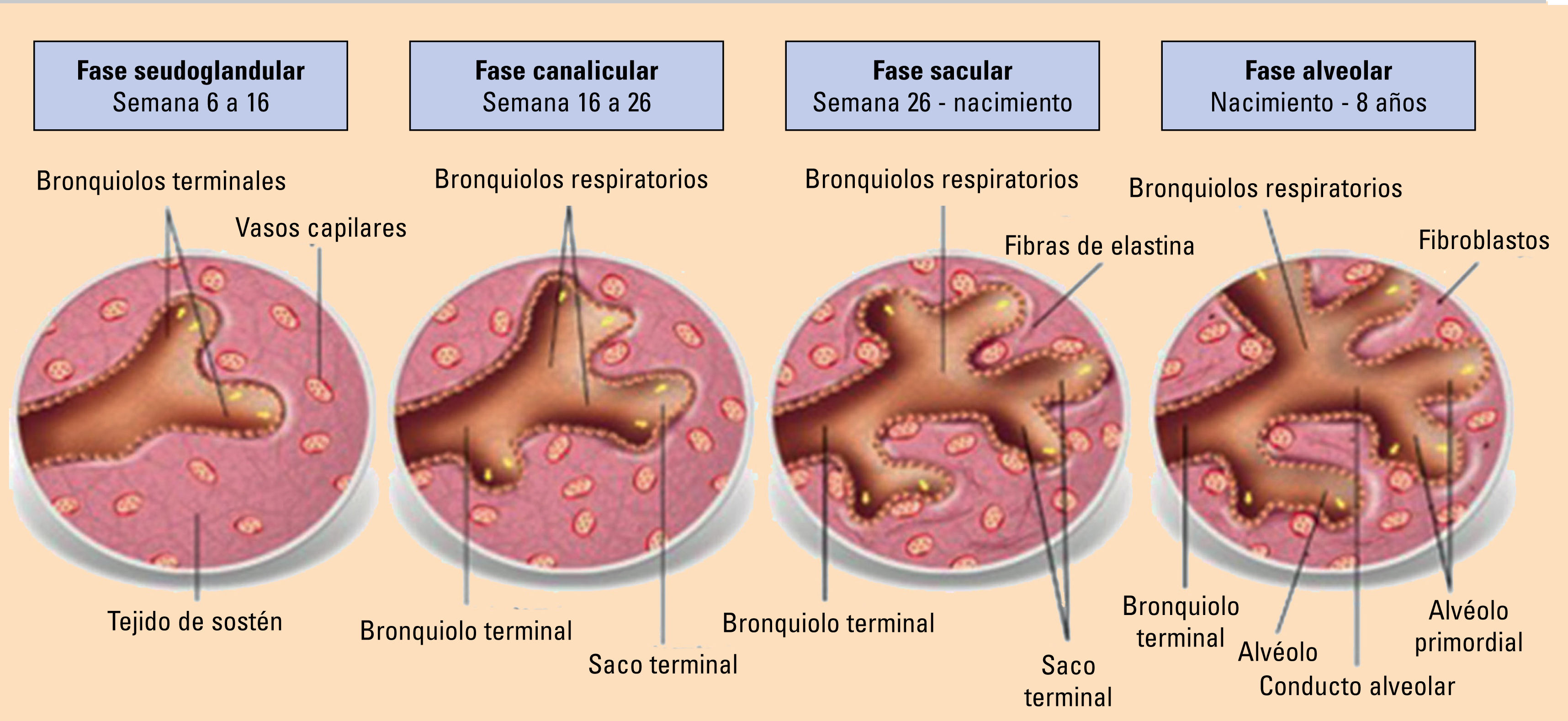 Enfermedades bronquiales y pulmonares hereditarias y congénitas - Medicine