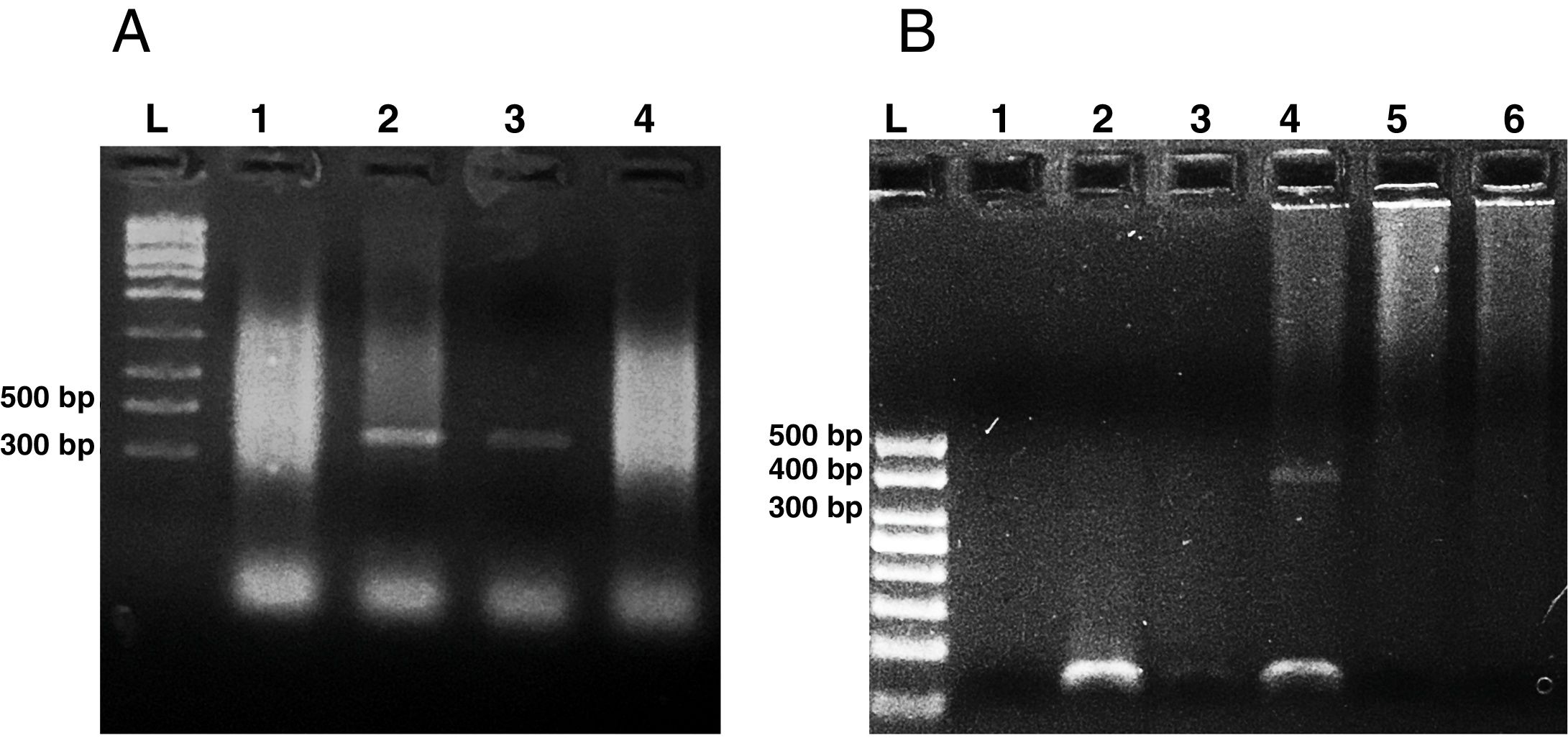 Microscopic and PCR-based detection of microsporidia spores in human ...