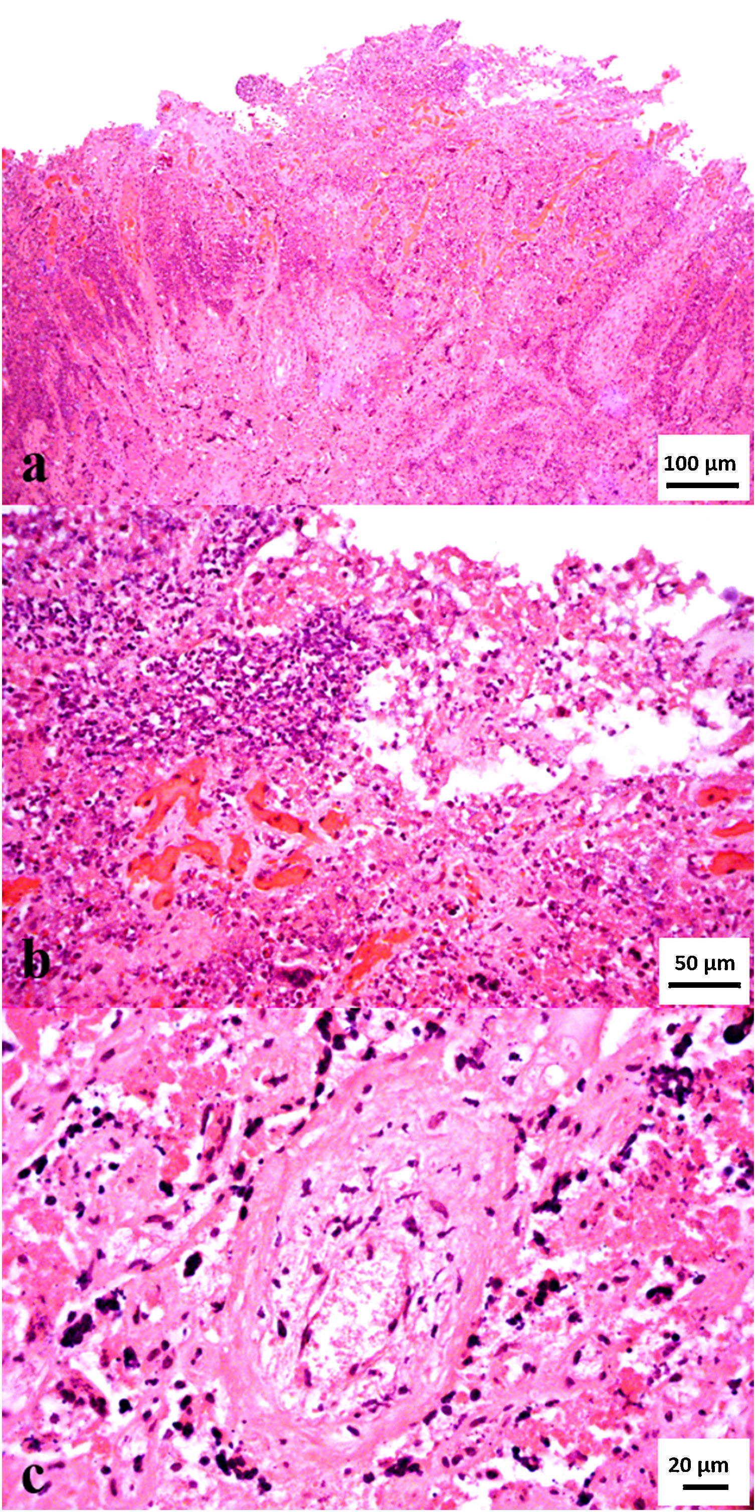 Placentitis and abortion caused by a multidrug resistant strain of ...
