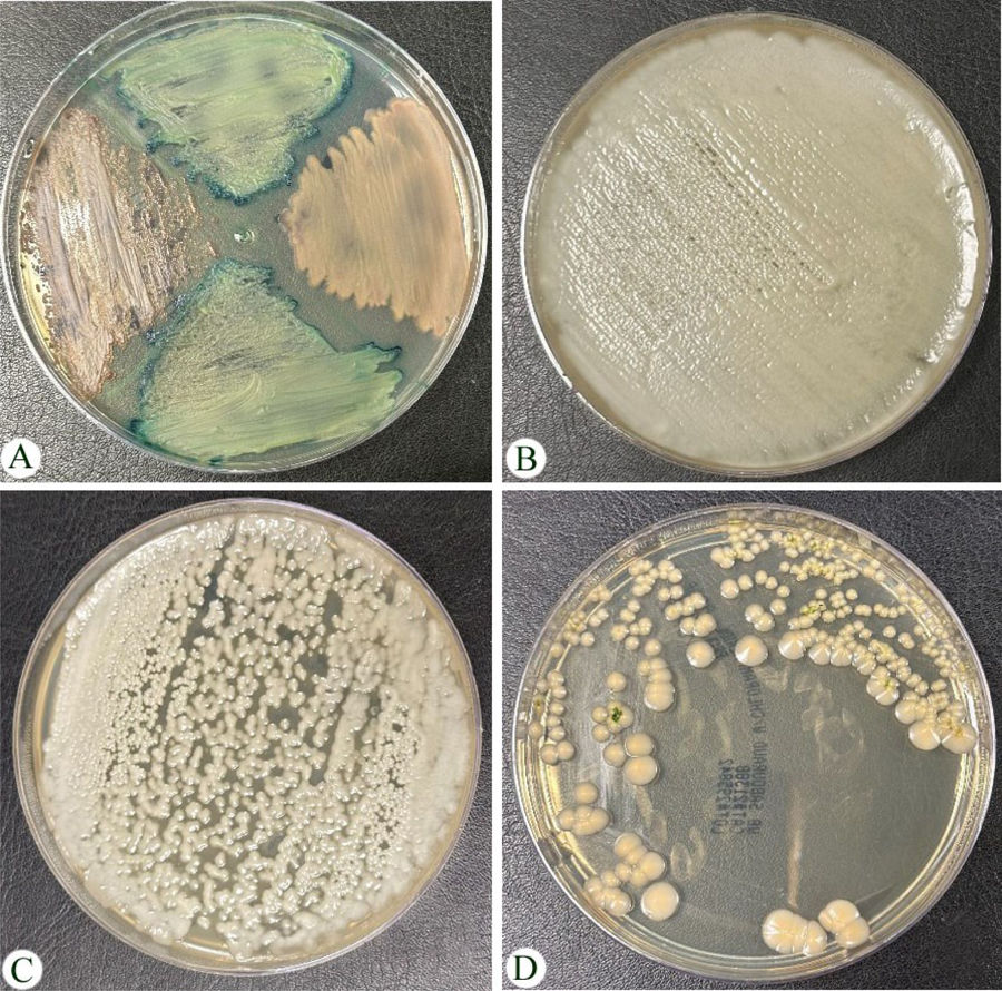 Identification of Candida species from fecal samples of pigeons in ...