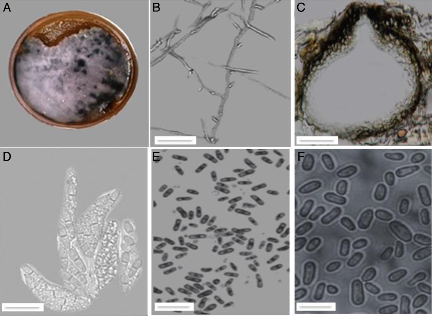 Antifungal and antioxidant potential of Ocimum species against ...
