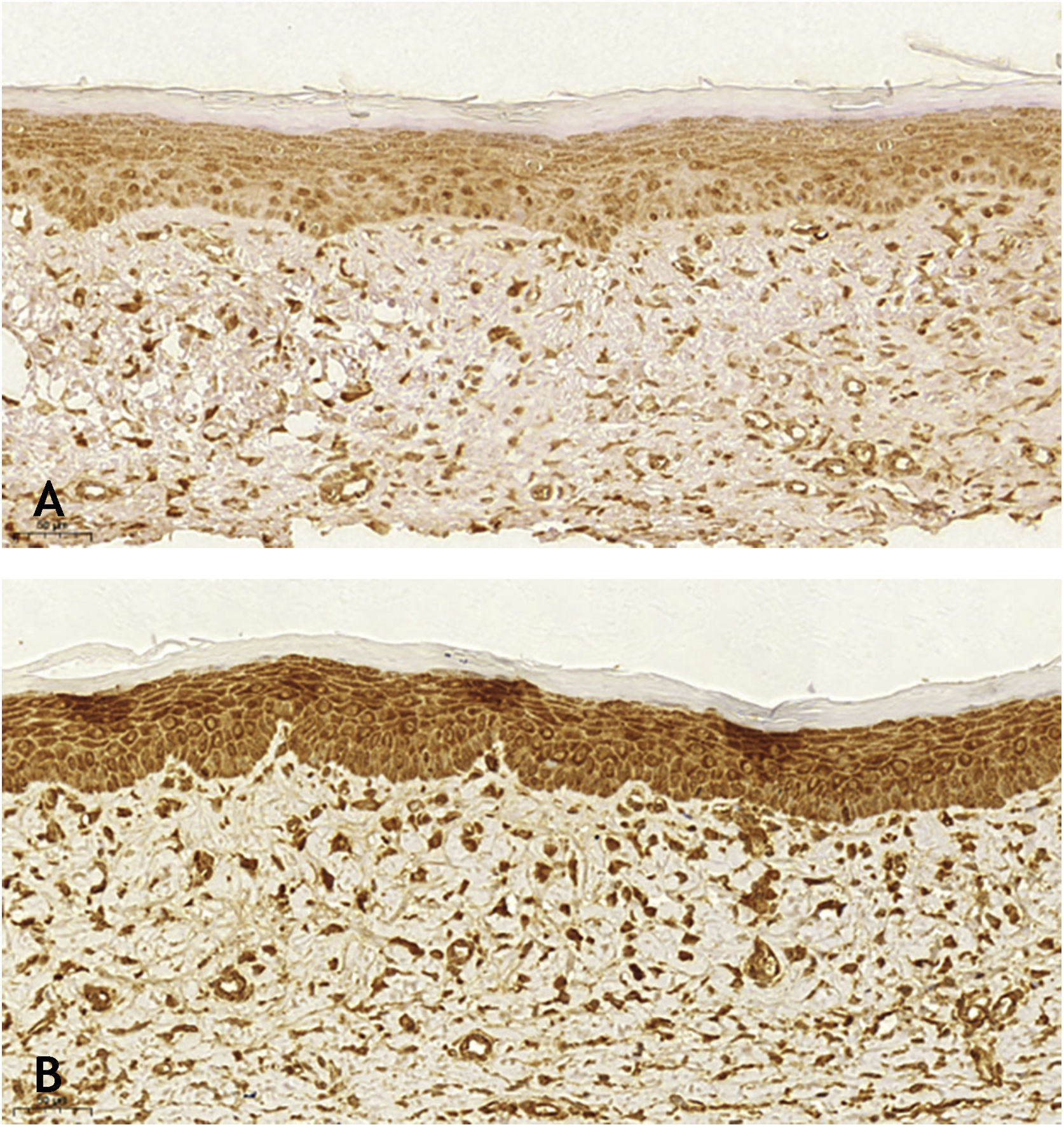 Tacrolimus action pathways in an ointment base for hypertrophic scar ...