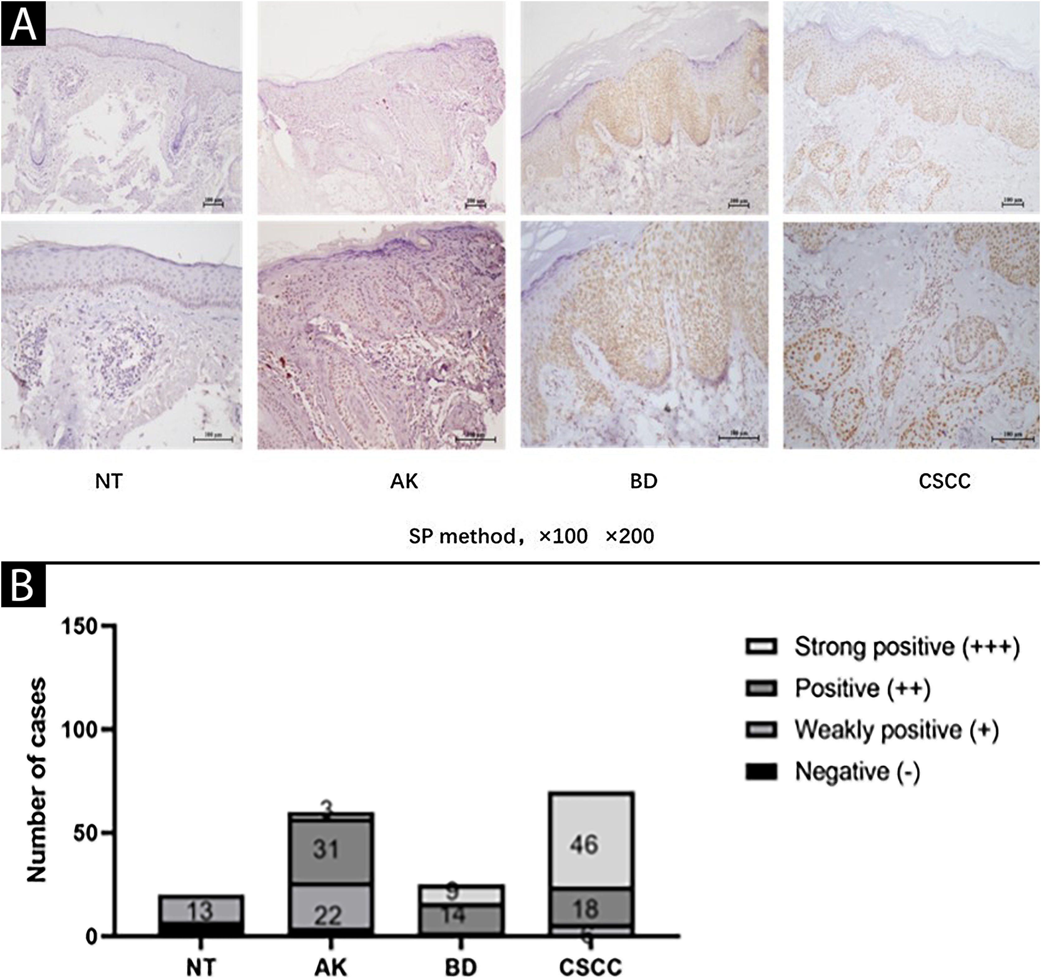 Expression analysis and biological regulation of silencing regulatory ...