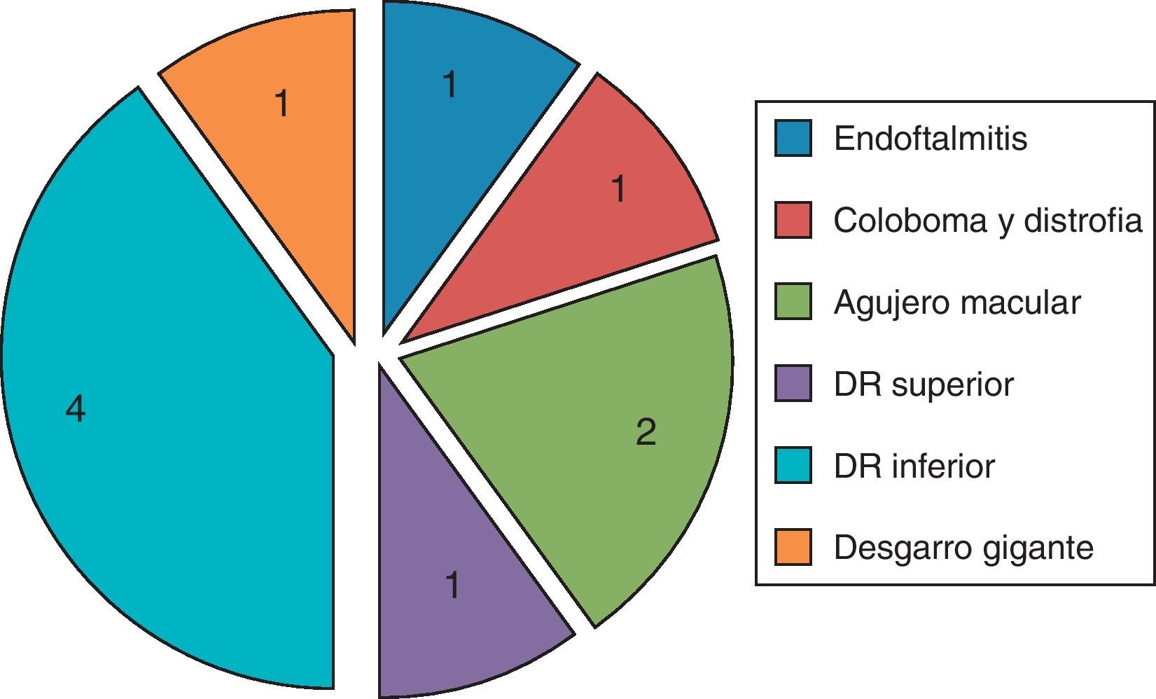 Aceite de silicona pesado (Densiron® 68) en vitreorretinopatía ...
