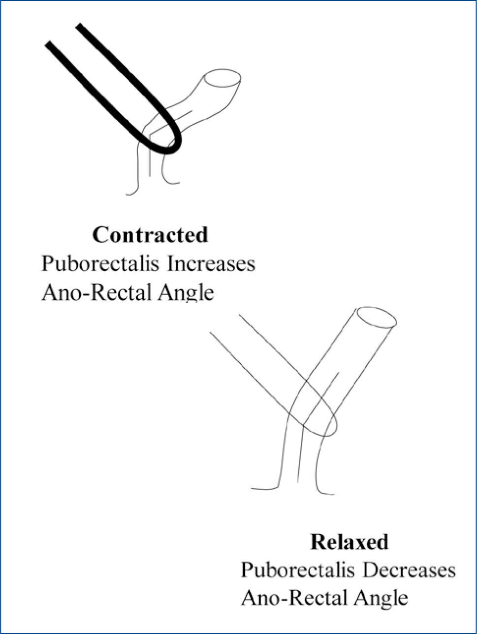 anal sphincter dysfunction