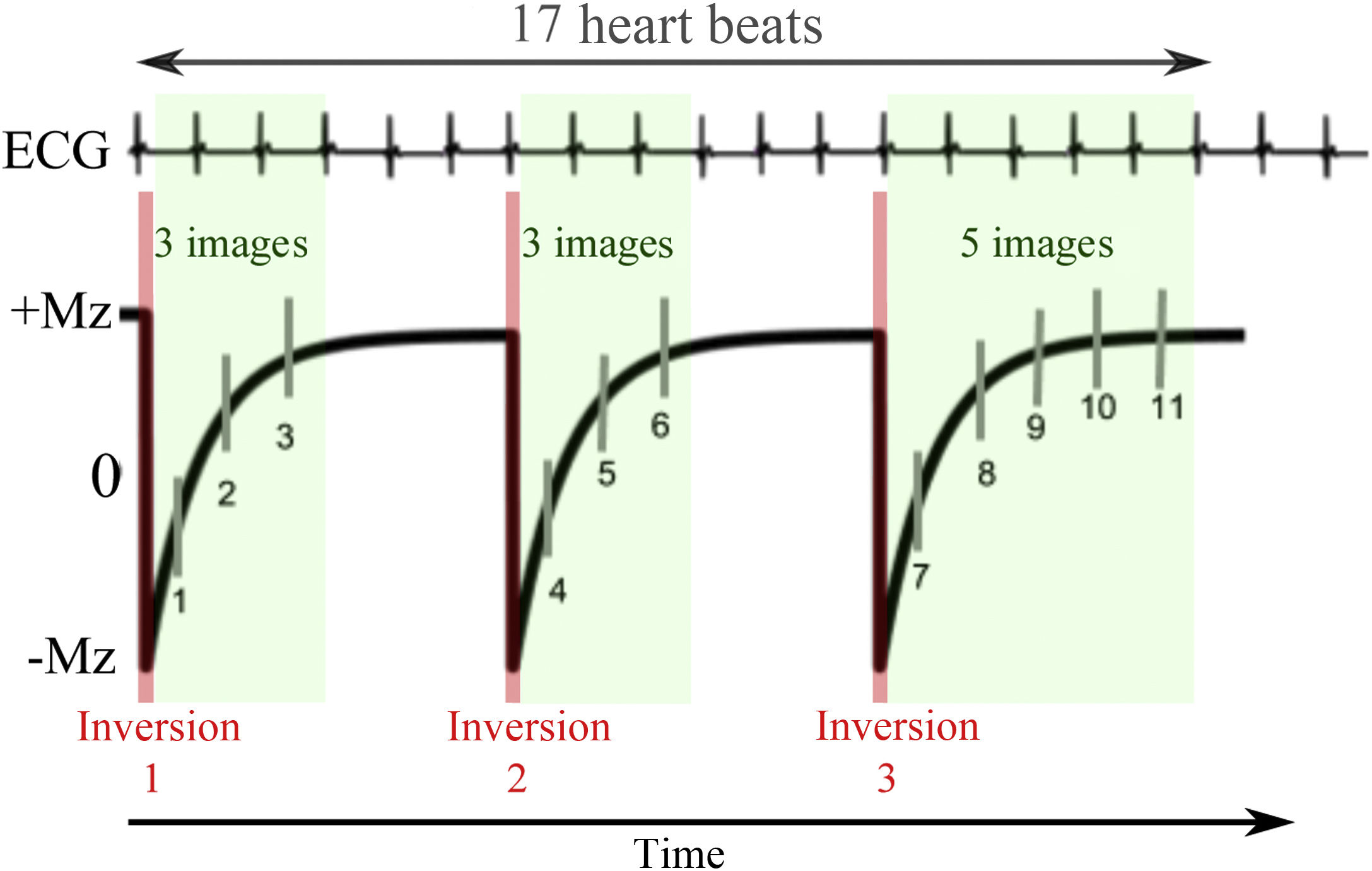 Myocardial T1 mapping with magnetic resonance imaging – a useful tool ...