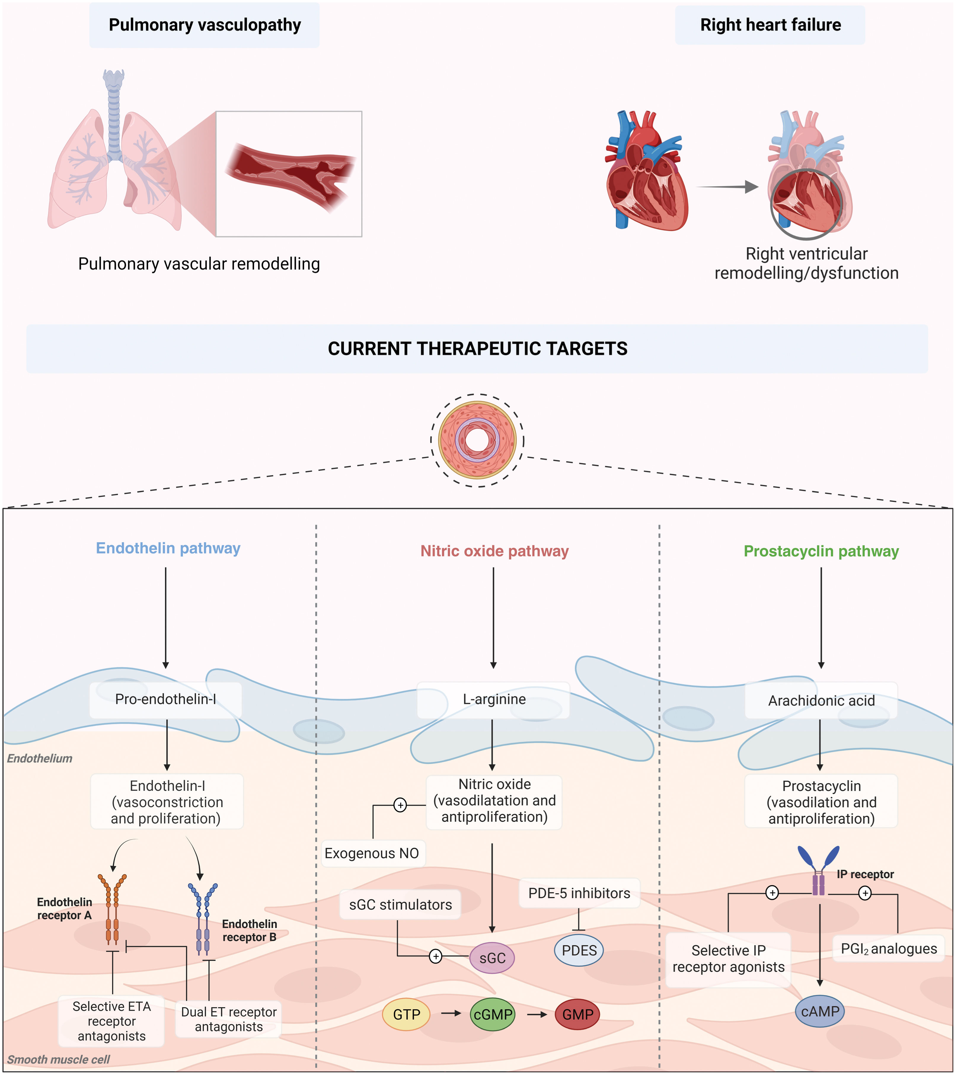 Pulmonary Arterial Hypertension Navigating The Pathways Of Progress In Pulmonary Arterial Hypertension Navigating The Pathways Of Progress In